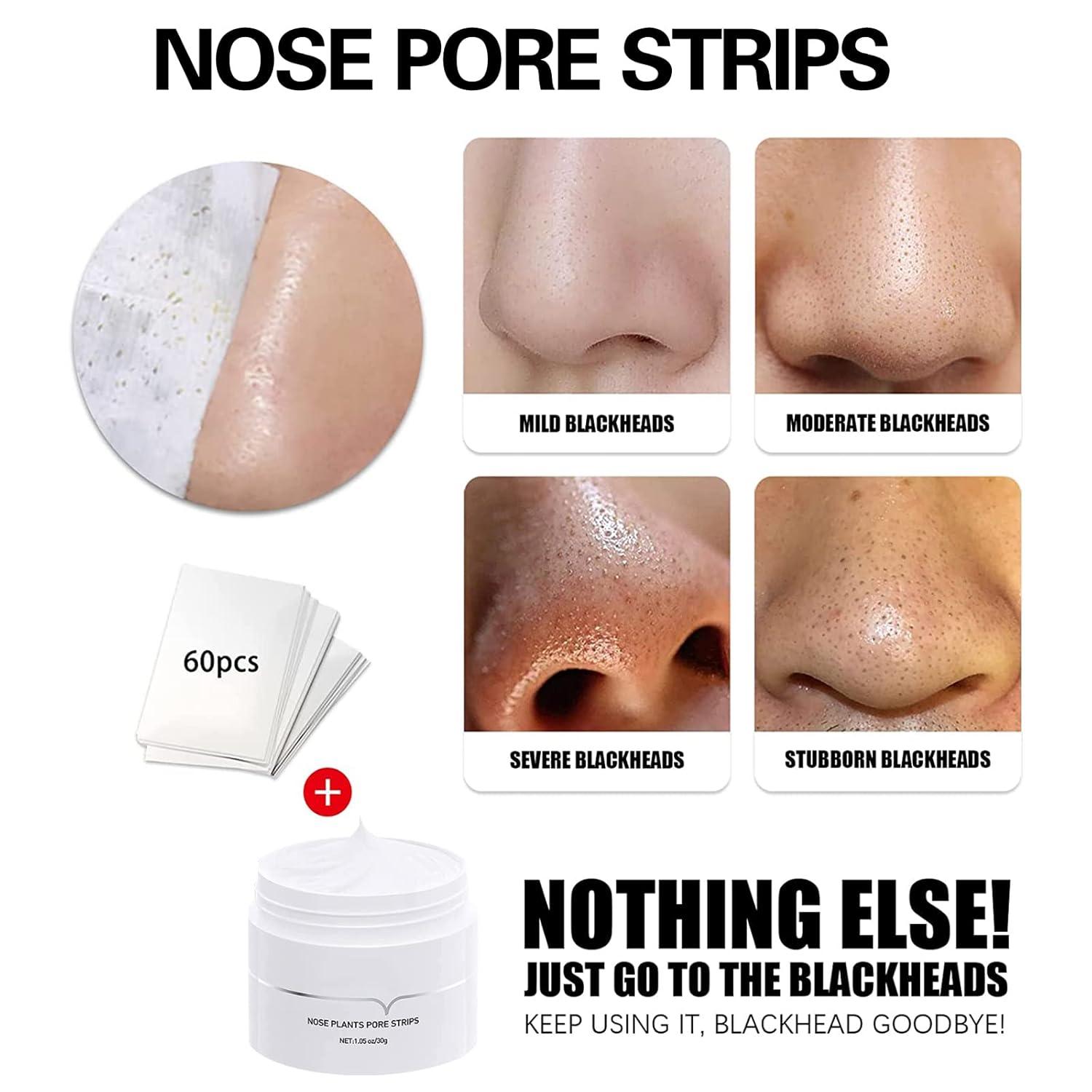 Effective Blackhead Remover Nose Strips - Pore Strips for Clear Skin ...