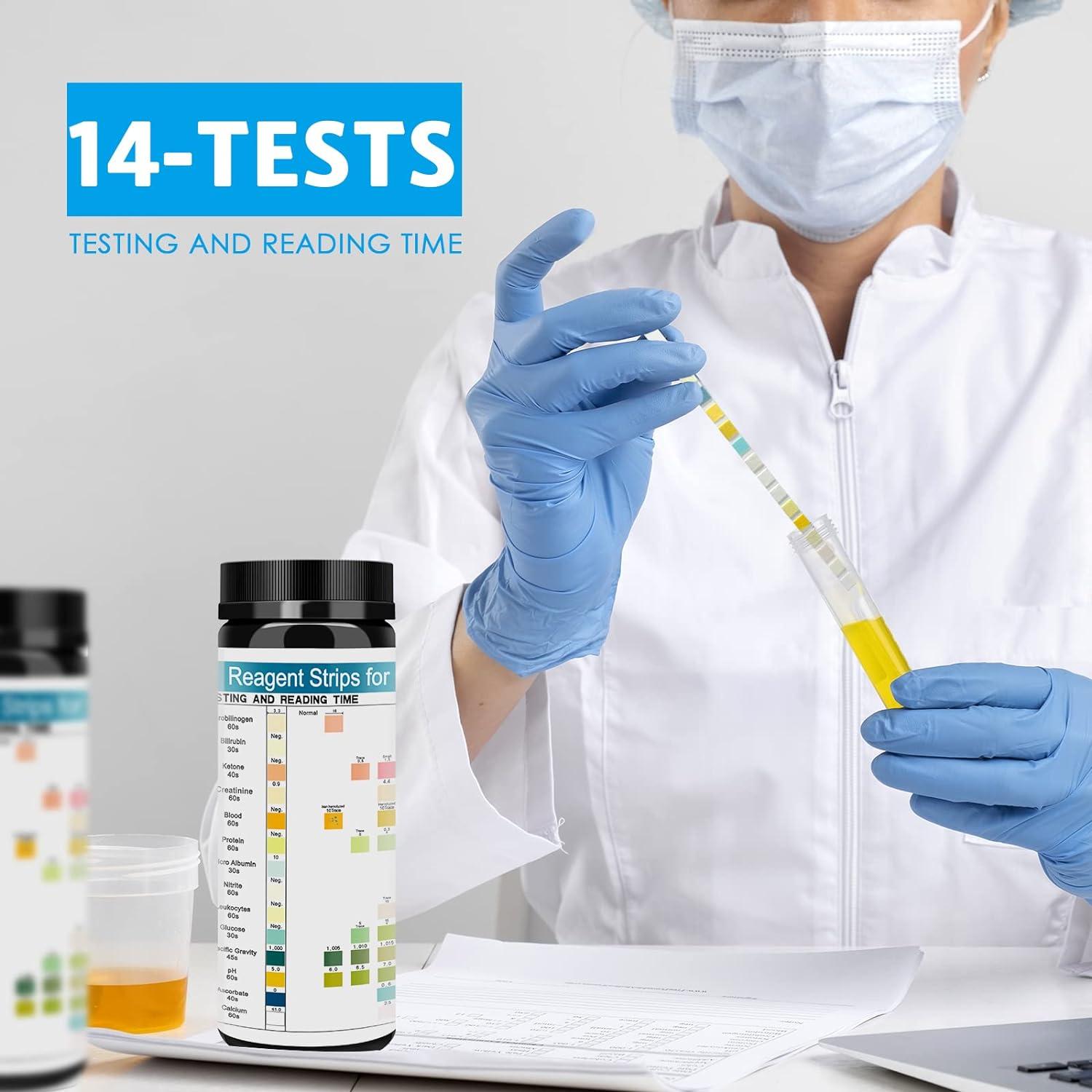 14 Parameter Urine Test Strips for Urinalysis - 100 Count | Buy Now ...