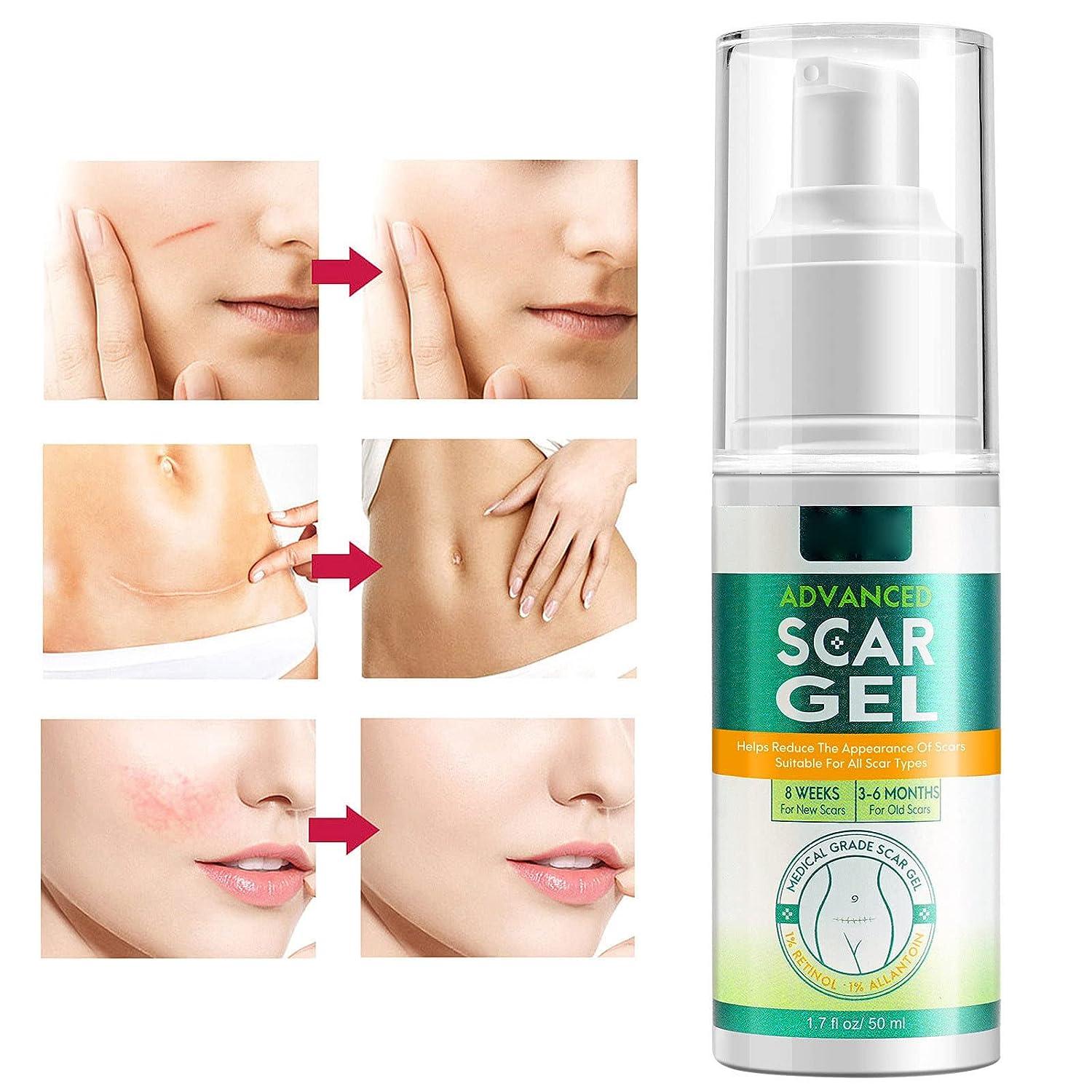 Scar Gel 50ml - For Burn, Surgical, Cesarean, Stretch Marks & Toenail ...
