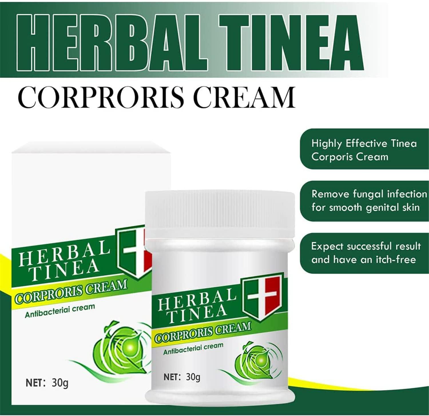 Herbal Tinea Corporis Cream for Skin Relief - Psoriasis and Itching ...