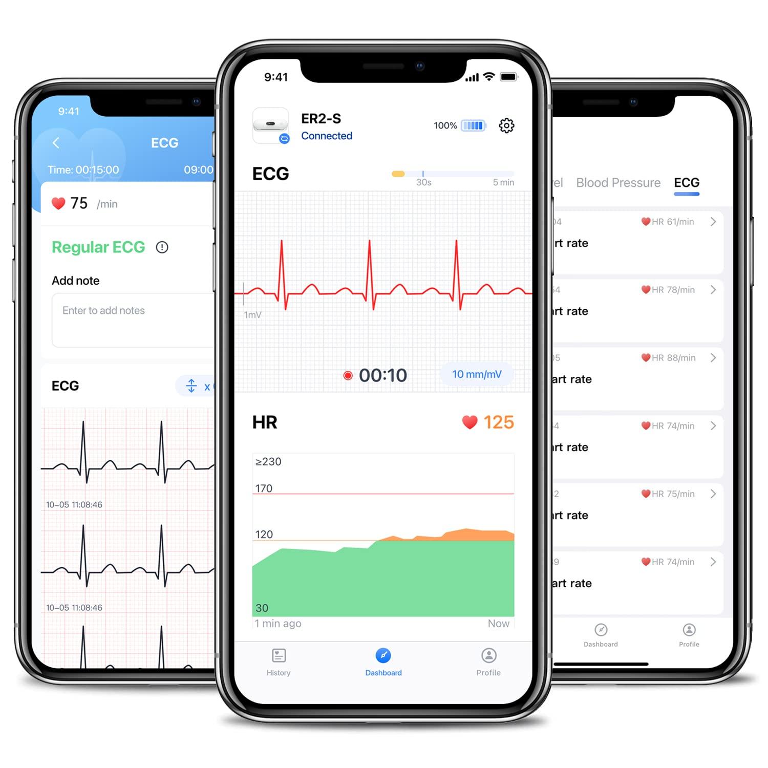 Wellue DuoEK-S Personal ECG Monitor - Bluetooth Wireless Portable Heart ...