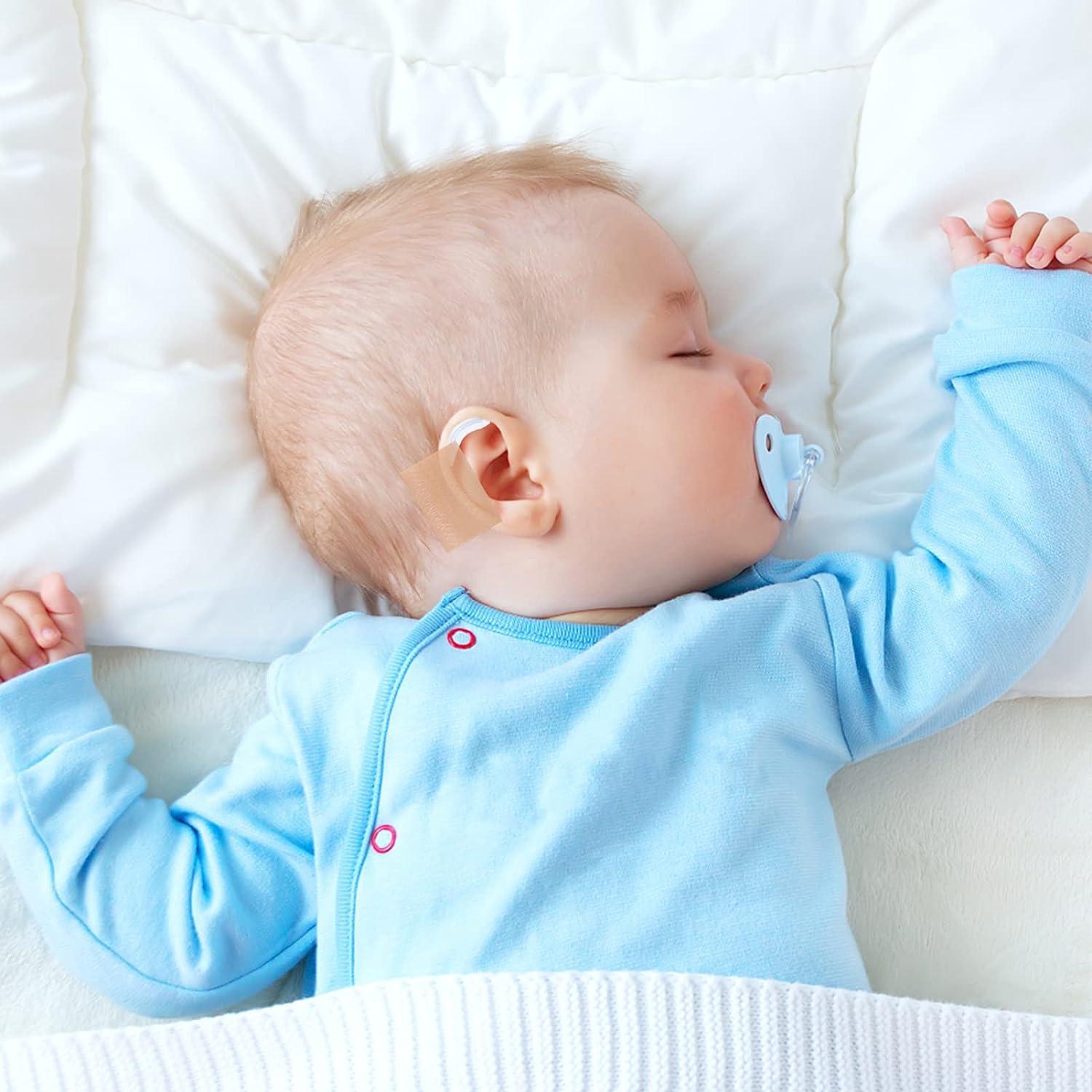 Auricle Correction Patch for Newborns - Infant Protruding Ear Corrector ...