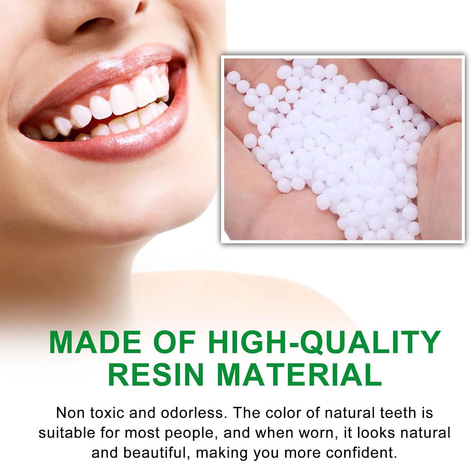 Temporary Tooth Repair Set | DIY Instant Veneers & Provisional Dentures ...