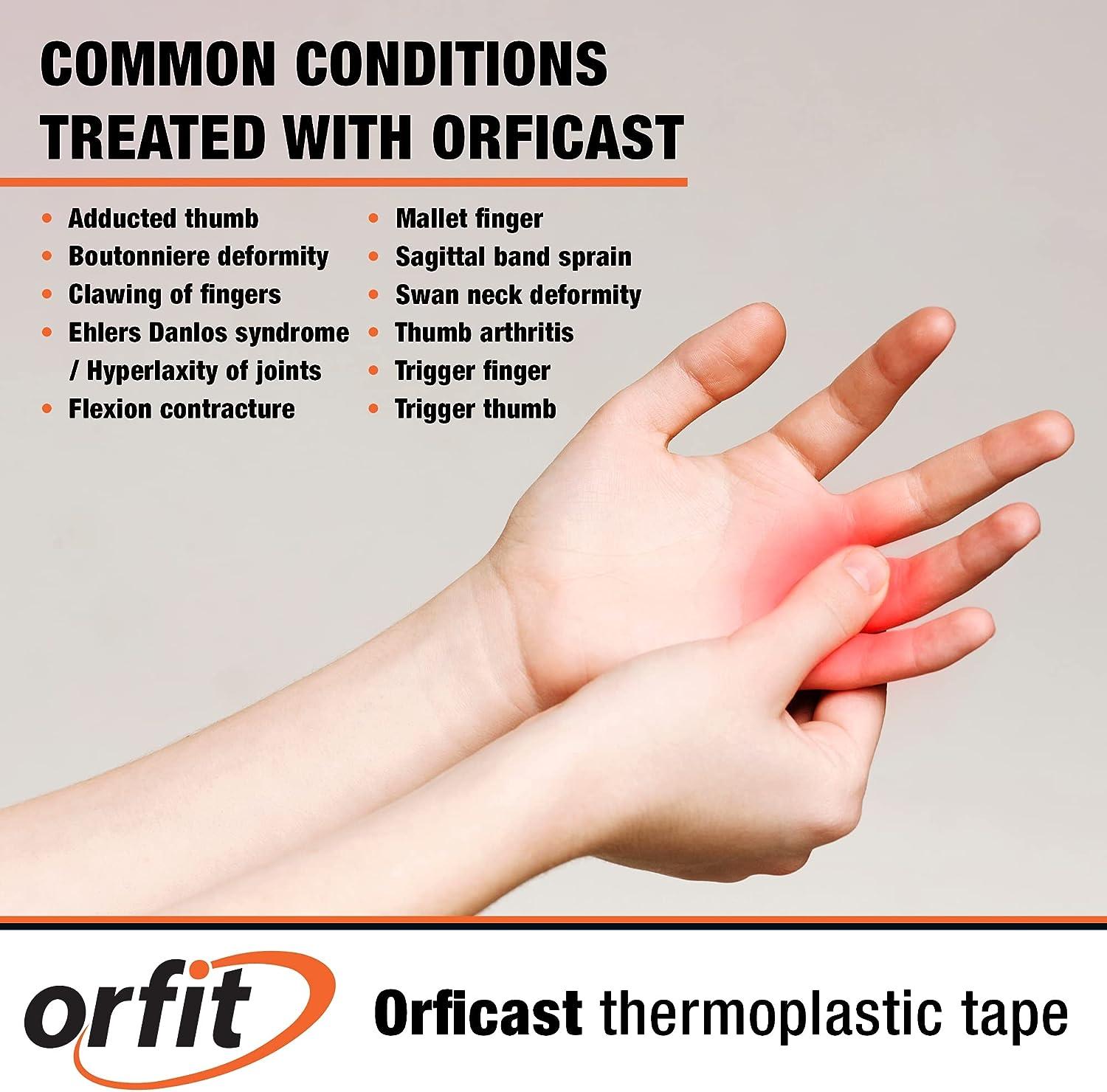 Orficast Easy-Form Splinting Tape for Trigger Finger & Thumb Pain ...