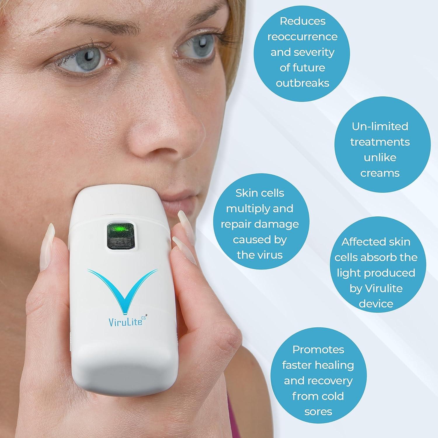 Virulite CS Original: FDA Cleared Cold Sore Treatment Device - 300 ...