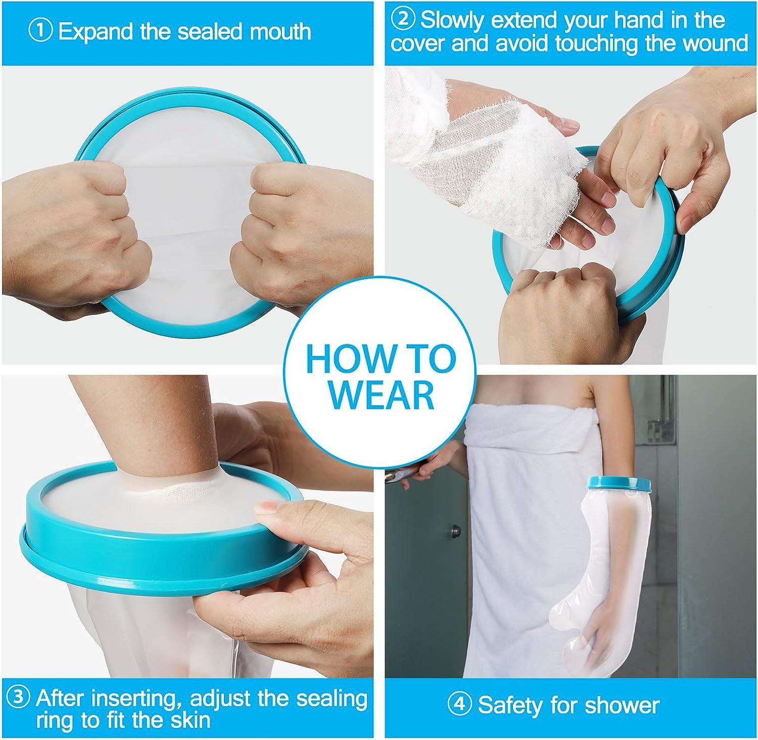 And Blue Wrist Fingers Cast