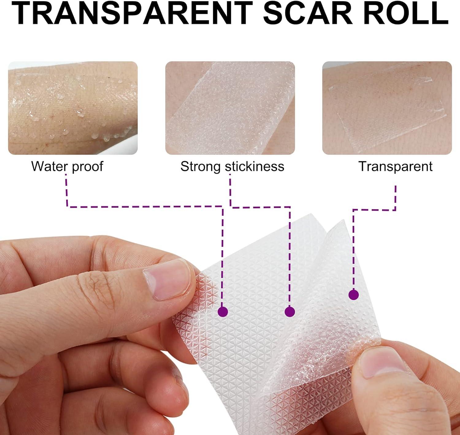 Silicone Scar Removal Tape Roll - Long Strips for Effective Scar ...