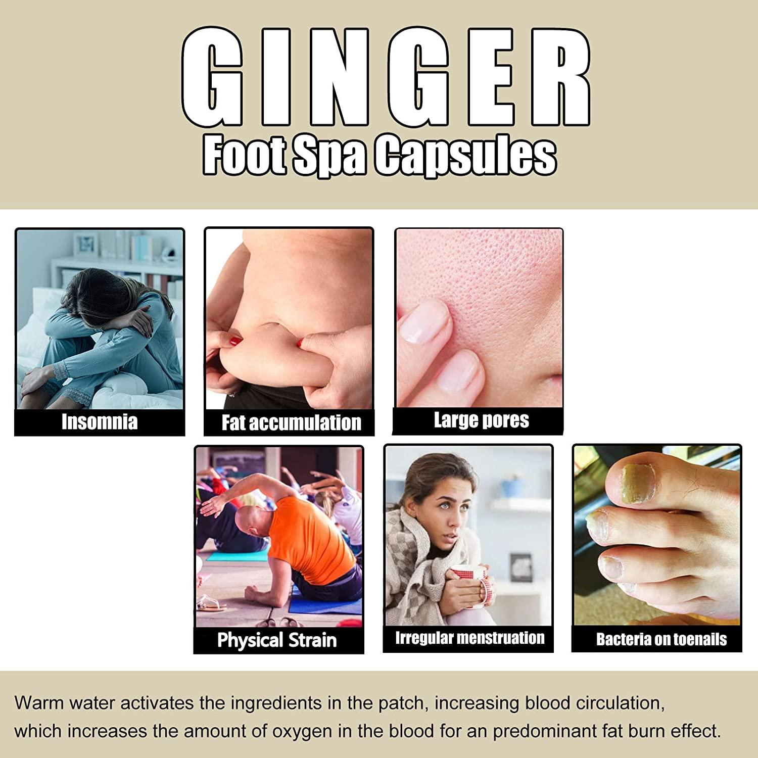 30PCS Lymphatic Drainage Ginger Foot Soak | Leg Slimming & Immunity ...