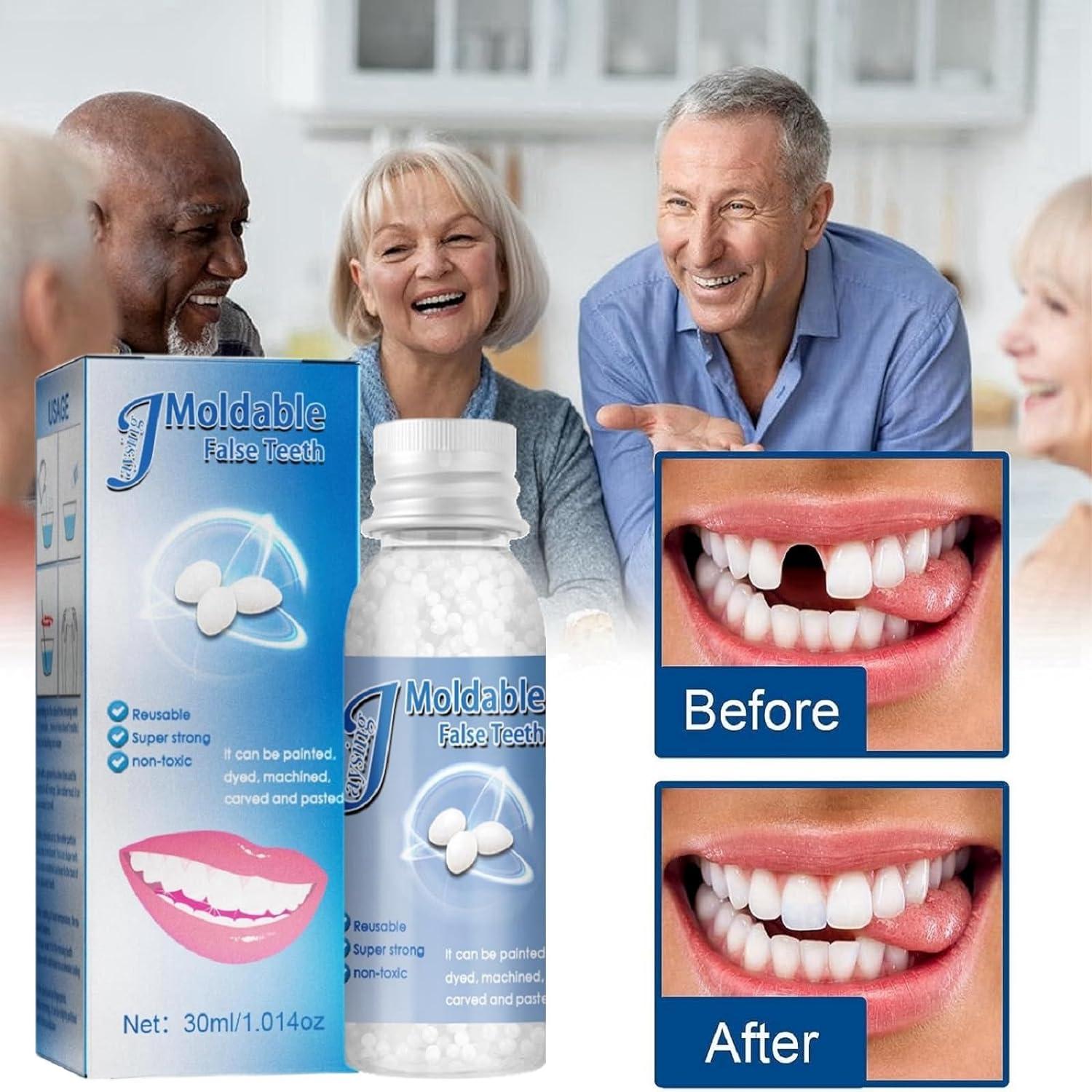 DIY Moldable False Teeth Repair Kit - Instant Tooth Filling Replacement ...