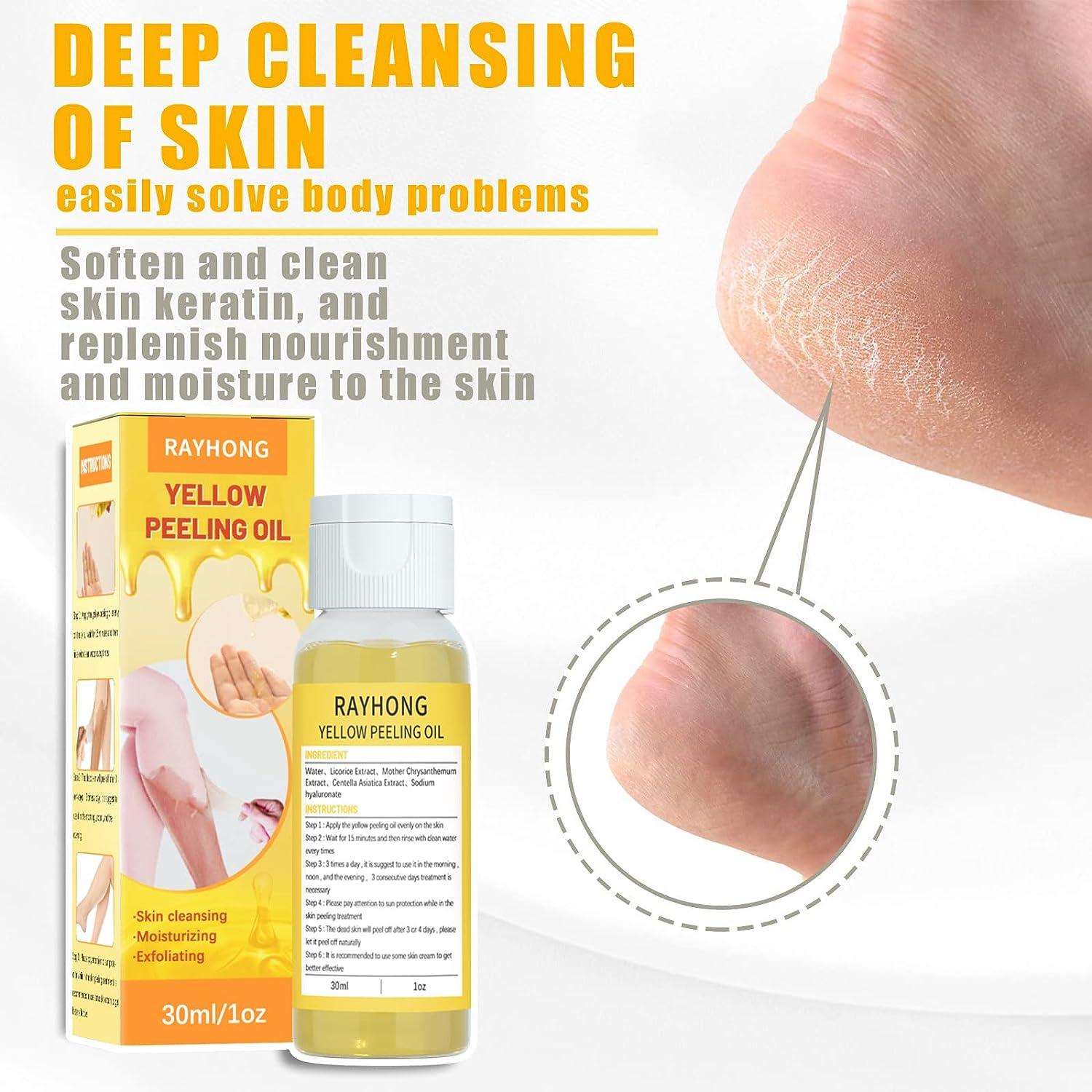Extra Strength Yellow Peeling Oil 30ML - Lighten Dark Spots, Brighten ...