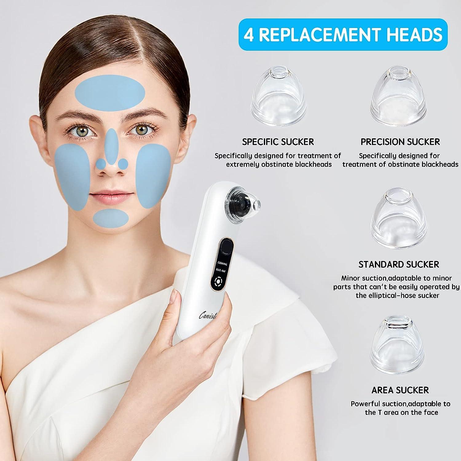 Blackhead Removal Tips