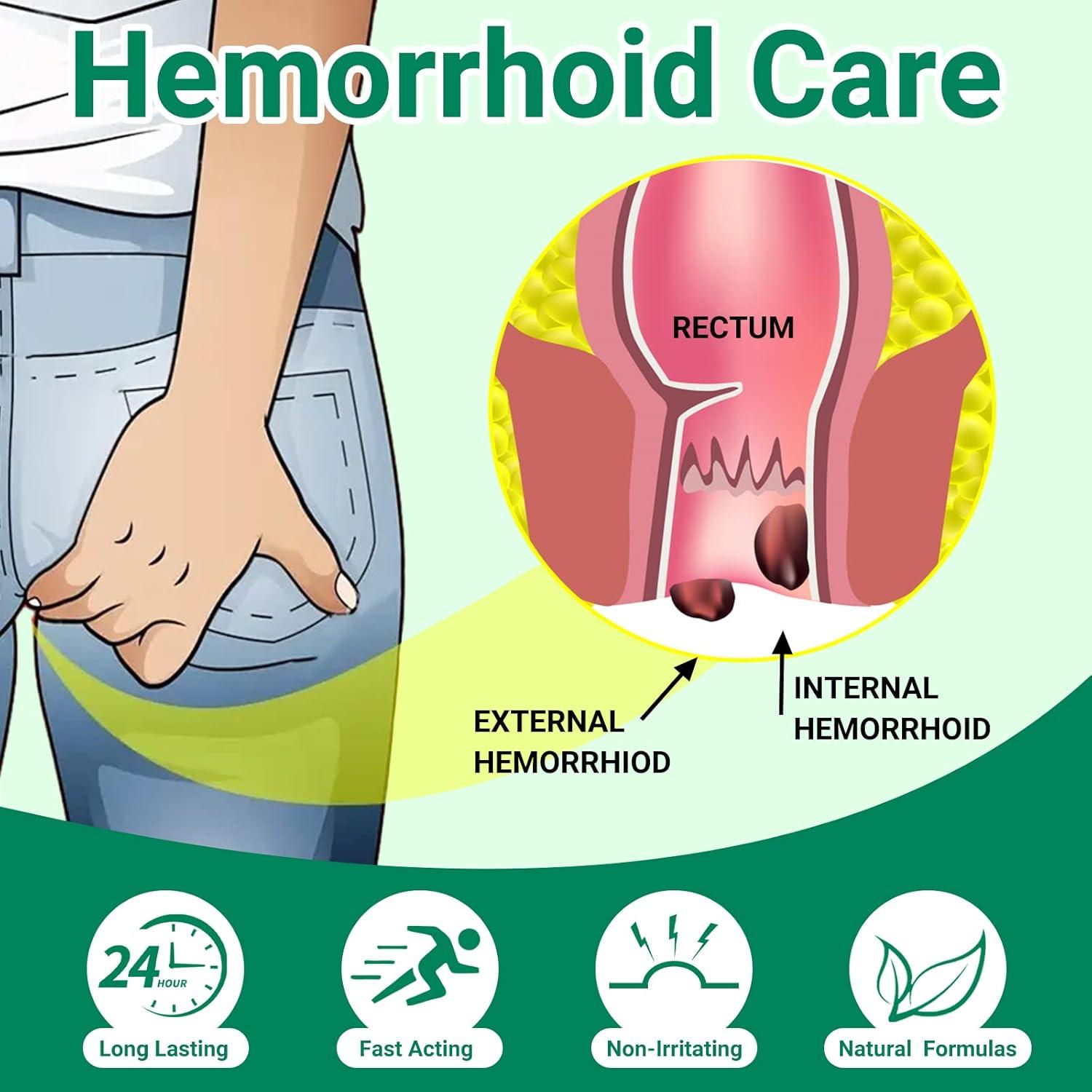 LMNOOP Hemorrhoid Treatment Ointment - Maximum Strength Fast Relief for ...
