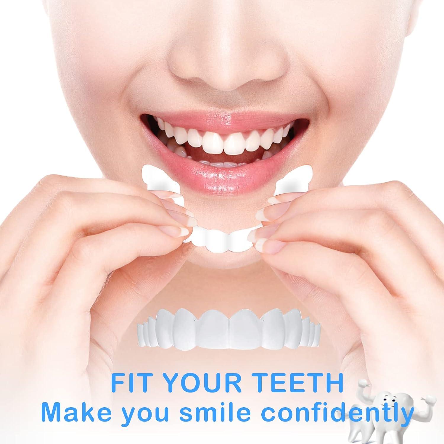 2 Pairs Cosmetic Veneers Teeth Set - Temporary Snap-On Dentures for a ...