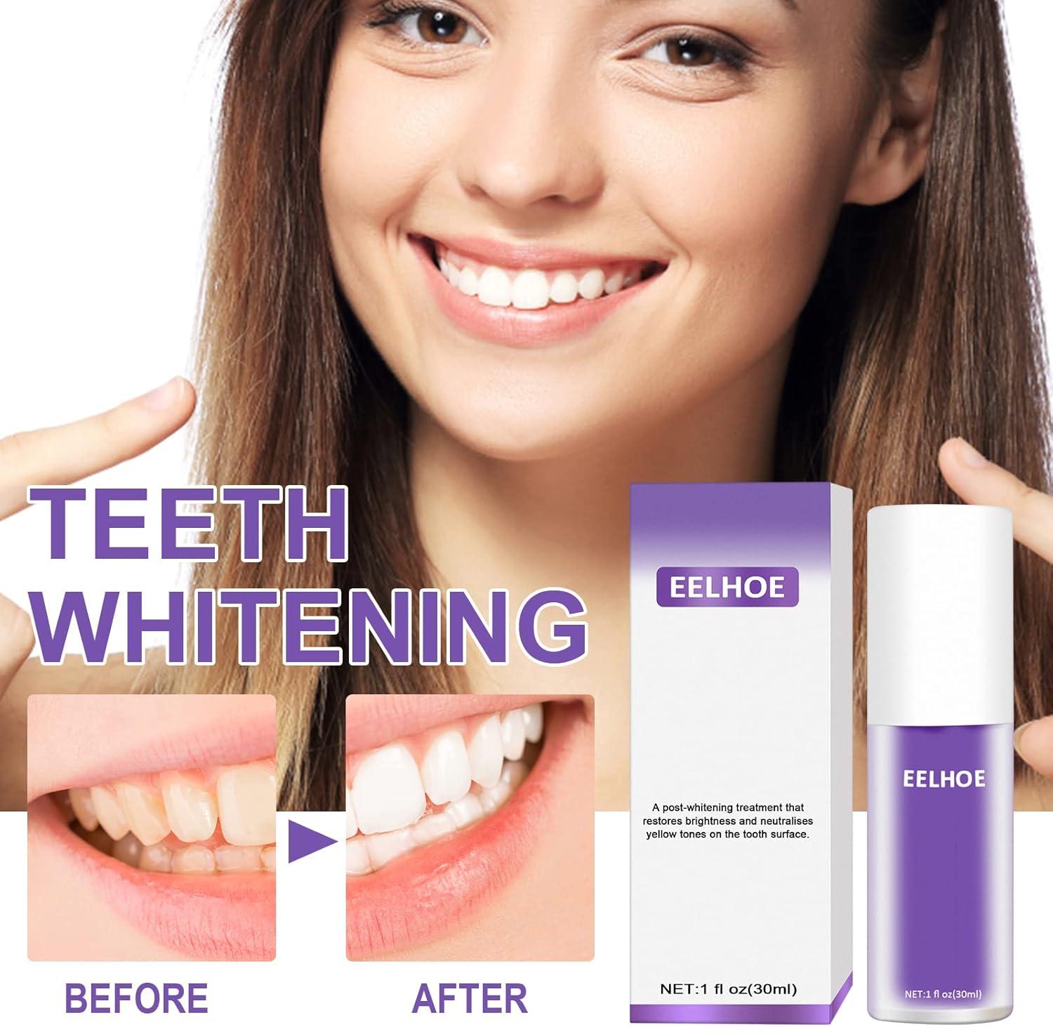 Purple Teeth Whitening Toothpaste - Intensive Stain Remover for ...