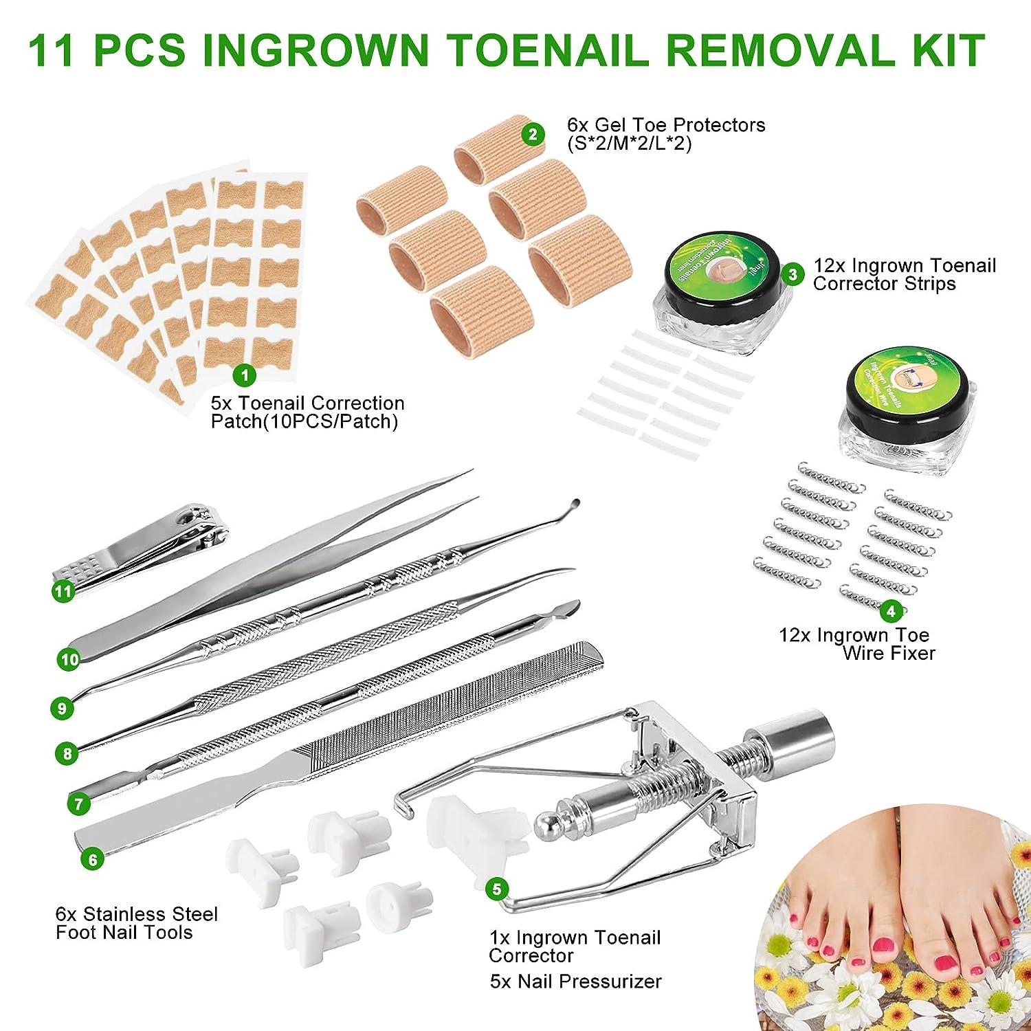 Ingrown Toenail Removal Kit - 11 Pcs Pain Treatment Tools for Seniors ...