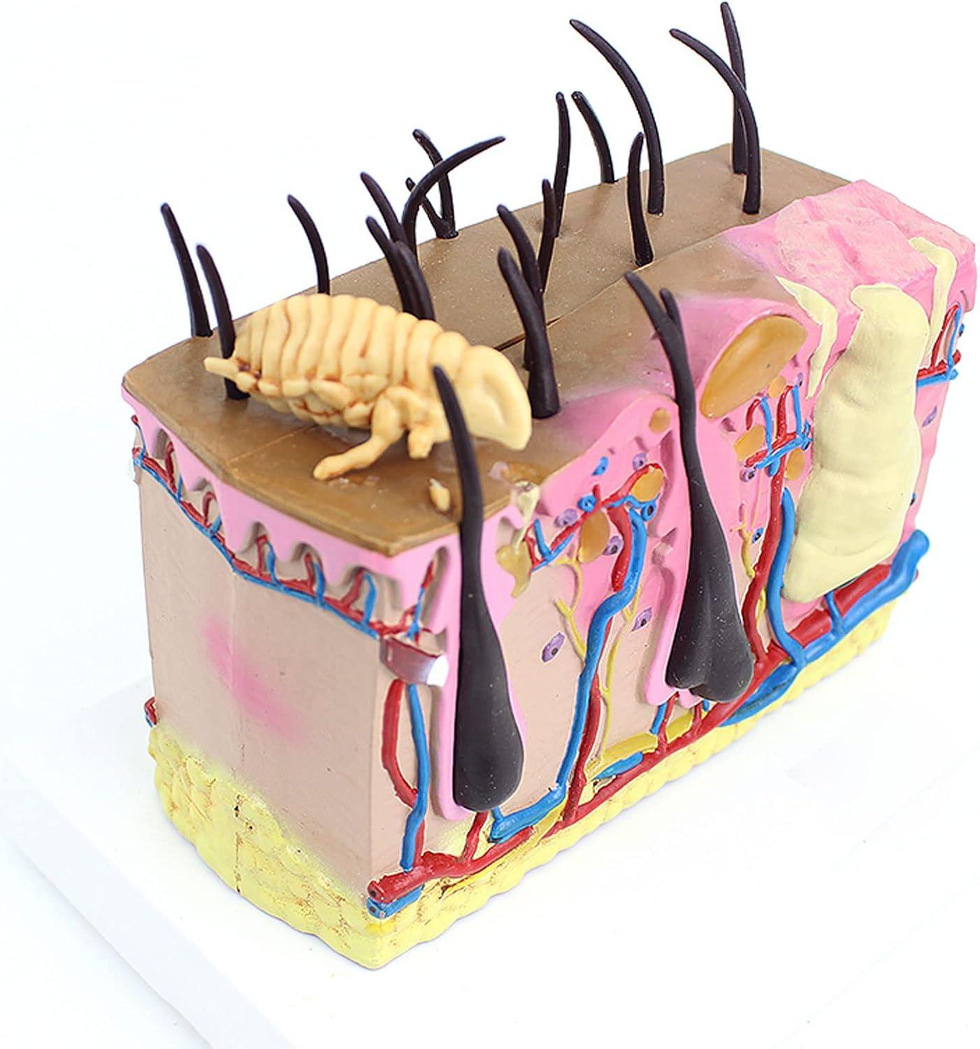 Dog Skin Model Insect Bite Pathology Mite Flea Hair Subcutaneous Tissue ...