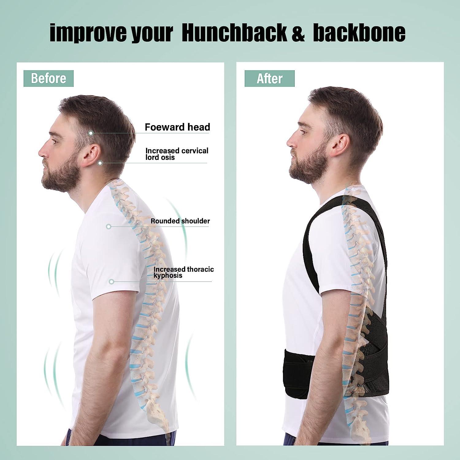 MOVSEA Posture Corrector for Men and Women - Relief and Improve Posture ...