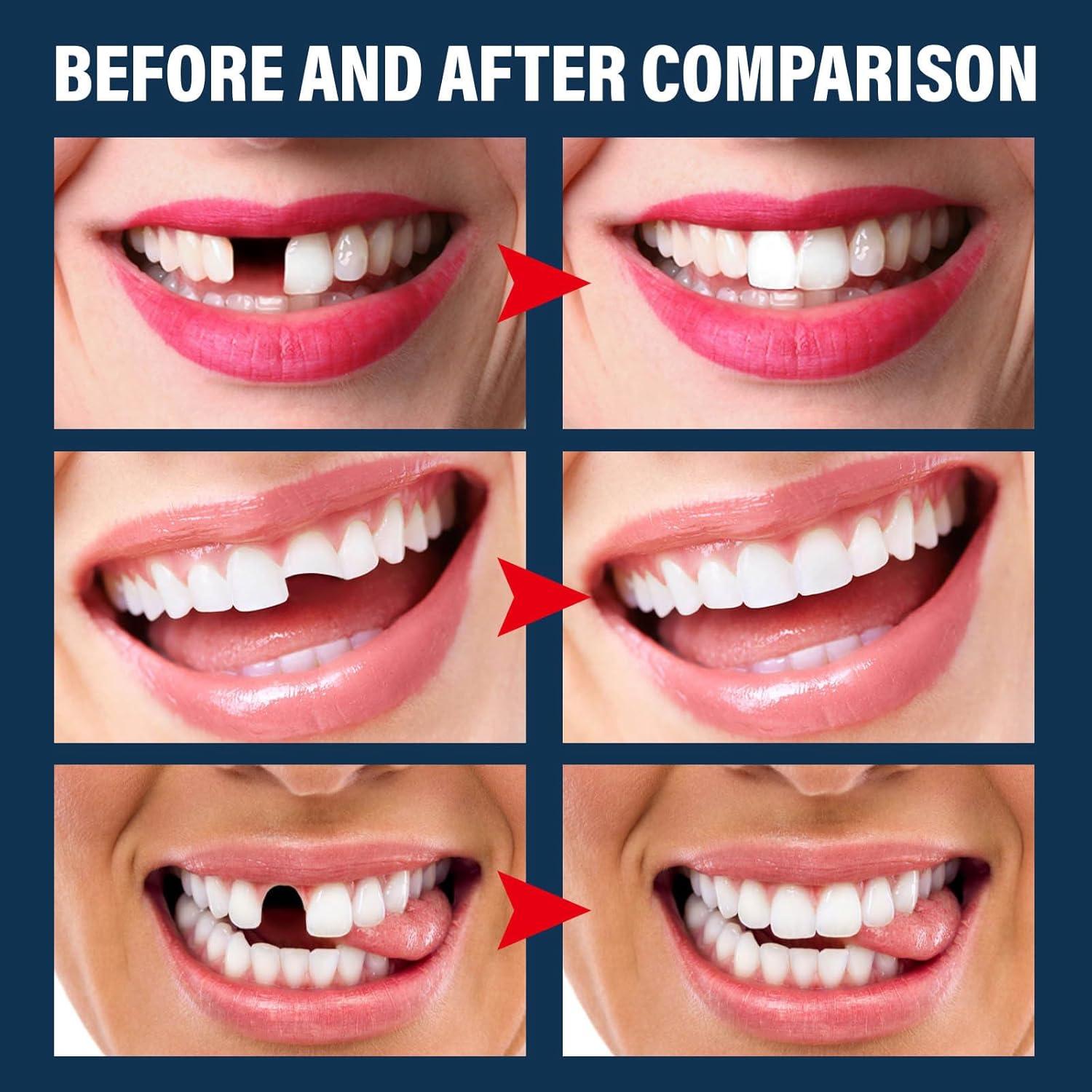 56 Pieces Full Acrylic False Teeth Dentures Kit - 2 Sets A2 Upper ...