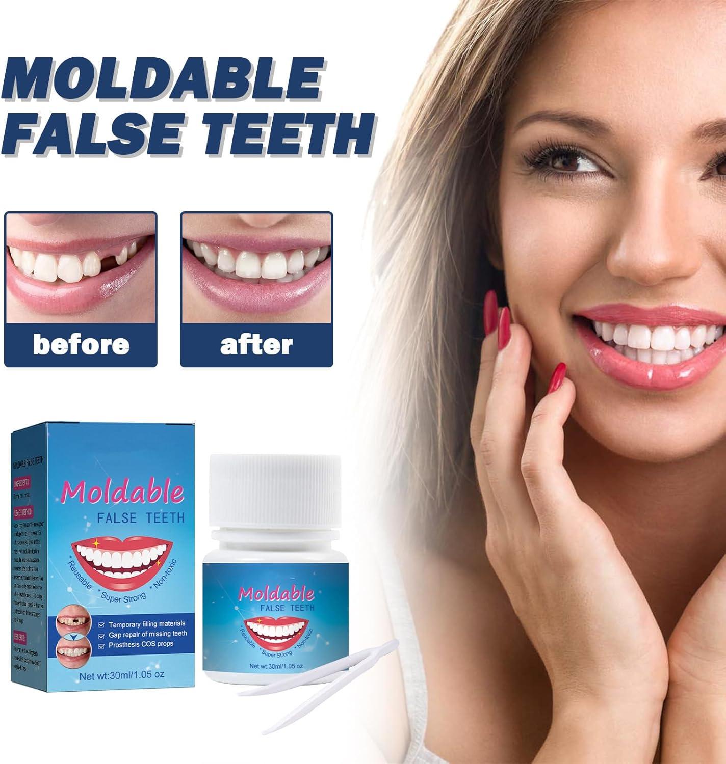 30 ml Tooth Repair Kit | Temporary Tooth Replacement & Moldable Thermal ...