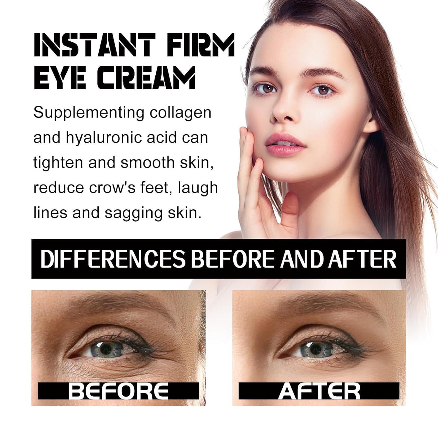 Buy Time Eraser Rollerball for Eyes - Reduce Wrinkles Dark Circles ...