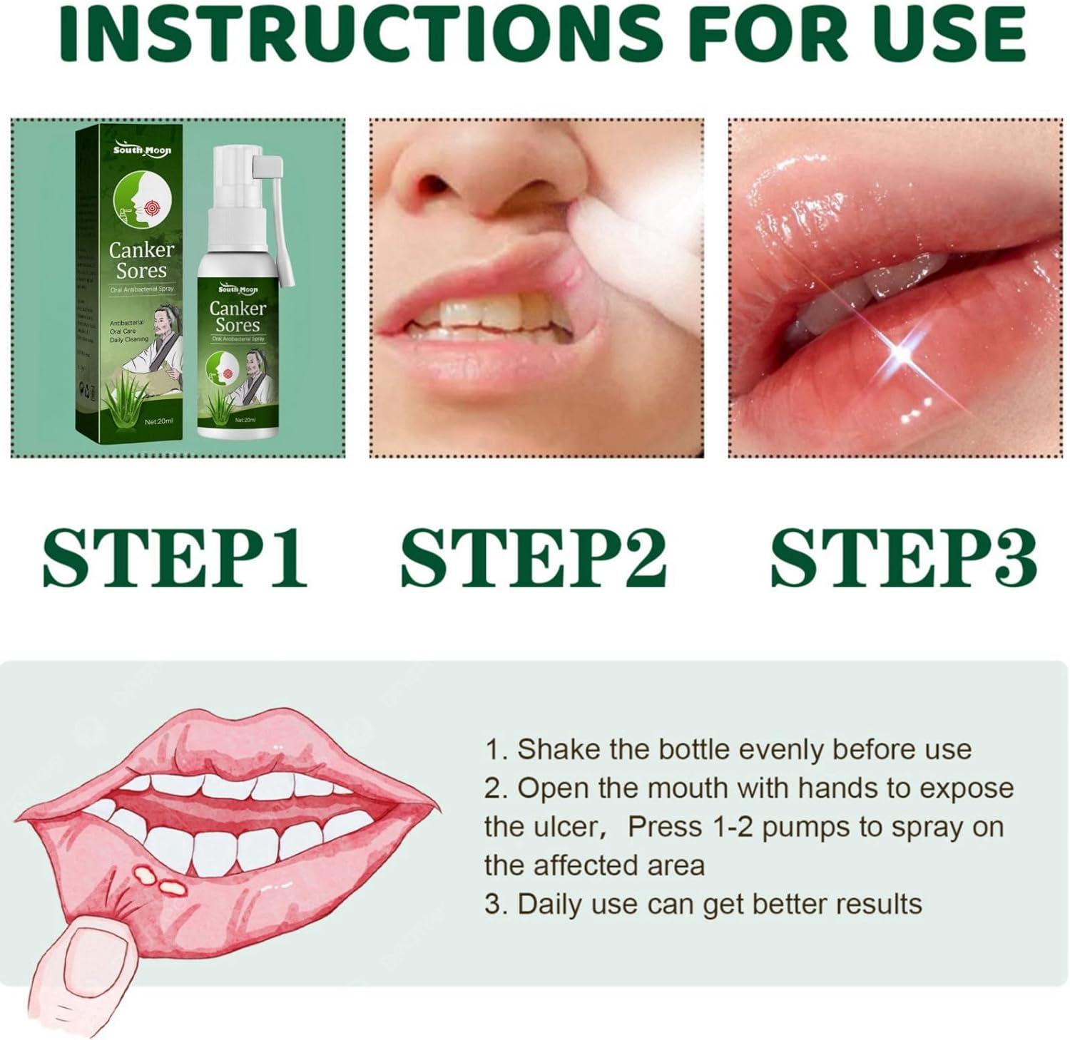 Mouth Ulcer Spray Mouth Ulcer Treatment Spray for Adluts Ulcer Breath ...