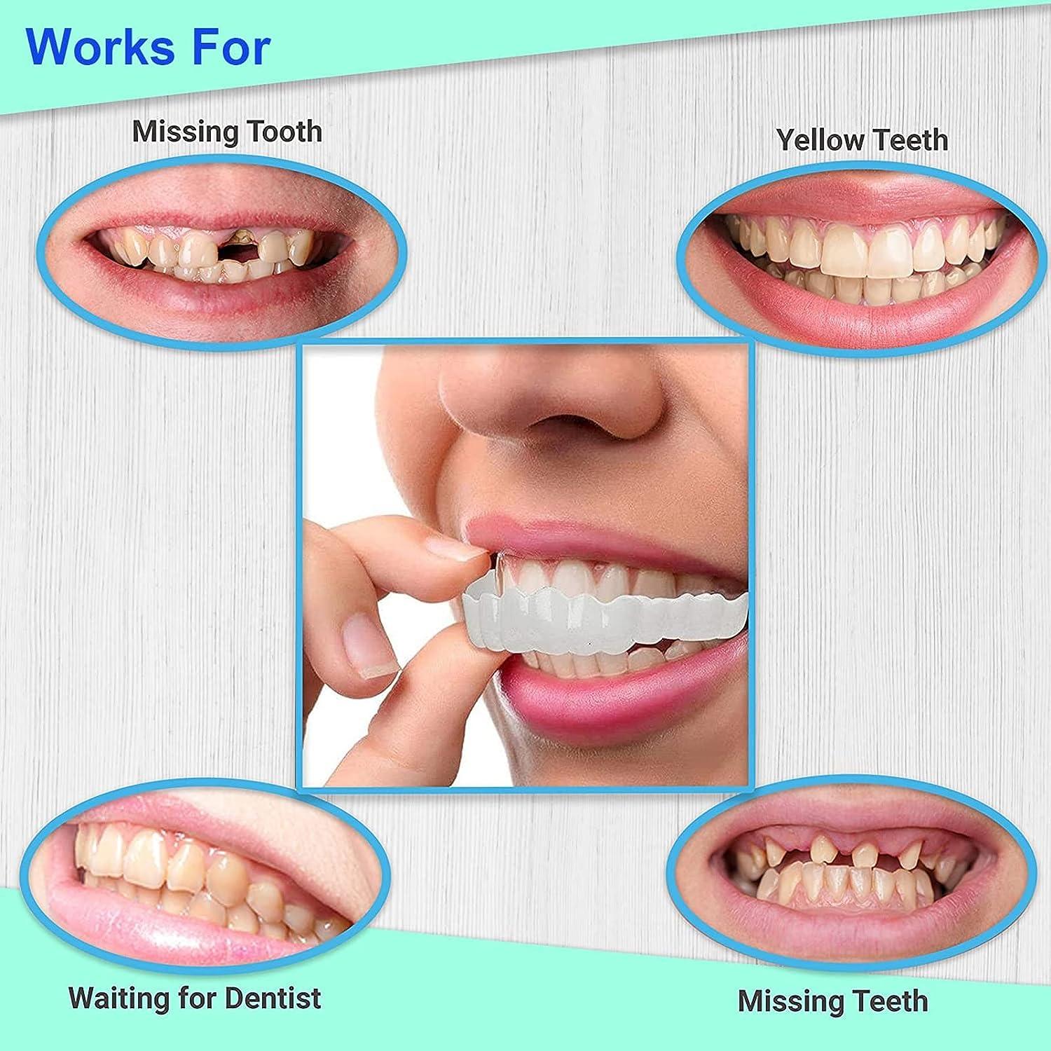 Dentures Fake Smile Teeth - Moldable & Customizable Top Teeth for ...