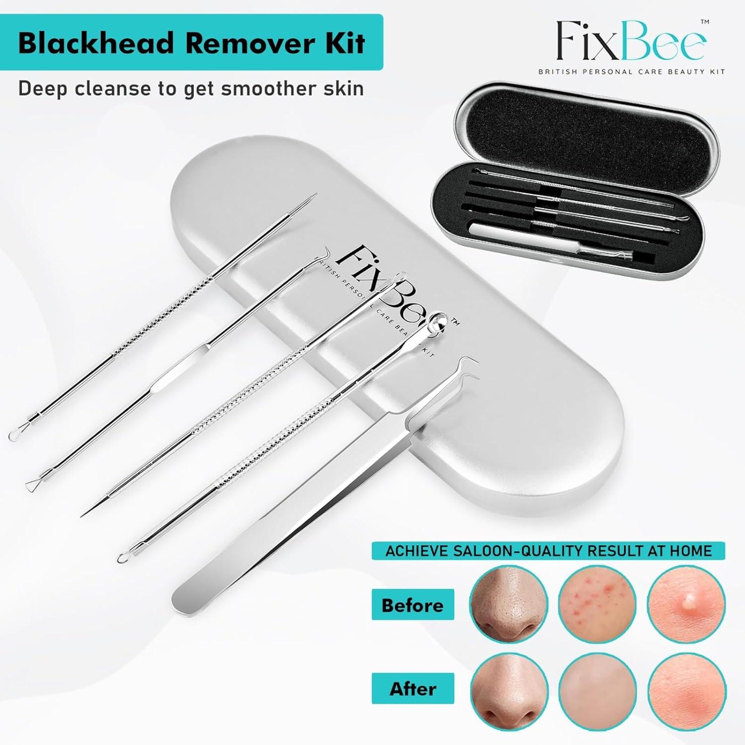 5PC Blackhead & Pimple Removal Kit with Tweezers - Facial Spot Popping ...
