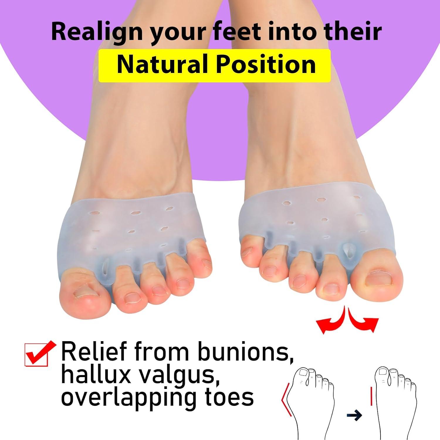 Toe Spacers & Metatarsal Pads (6PCS) - Relief for Bunion Pain Plantar ...