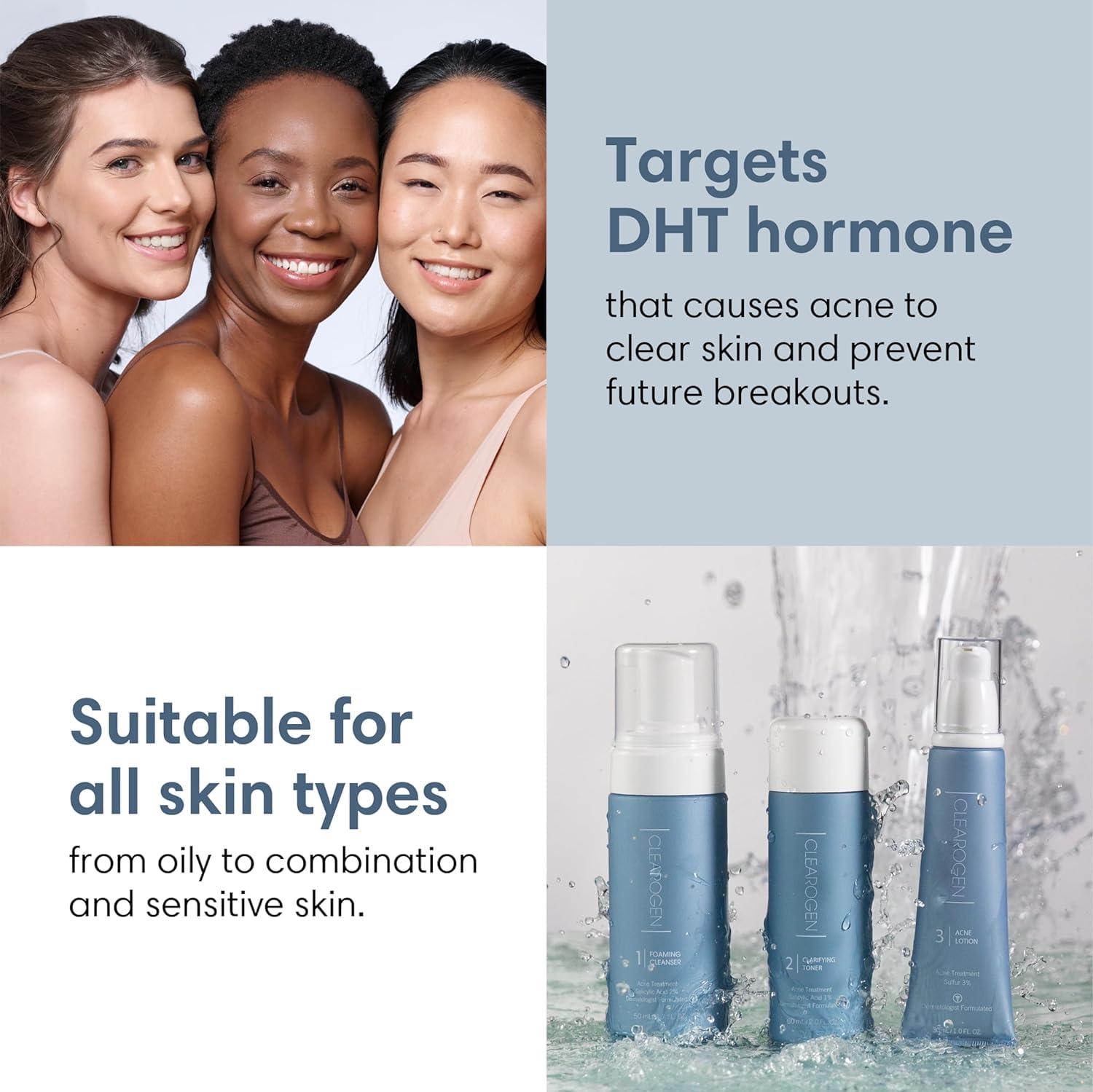 Natural Hormonal Acne Solution | Anti-DHT Ingredients | Deluxe 3-Piece ...