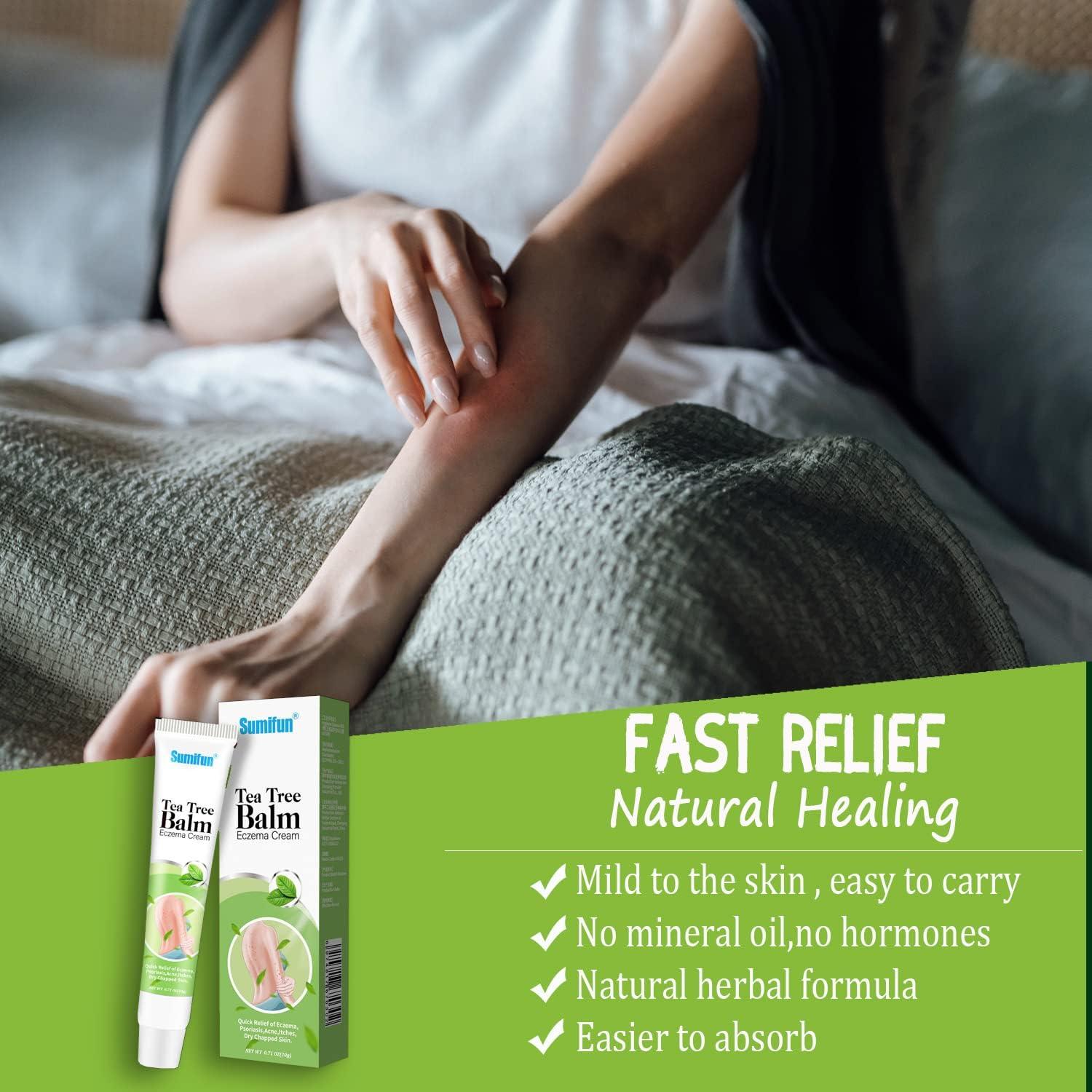 Tea Tree Oil Anti-Itch Cream for Psoriasis & Eczema - Natural Herbal ...