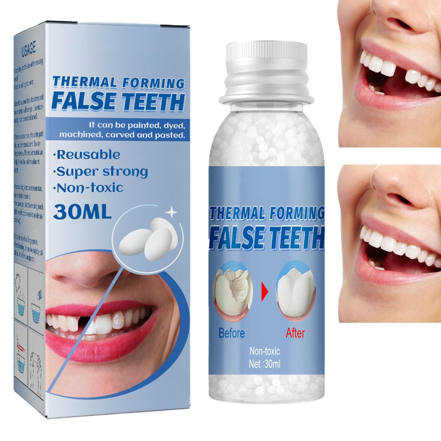 Temporary Tooth Filling Repair Kit - Instant Tooth Filler for Broken ...