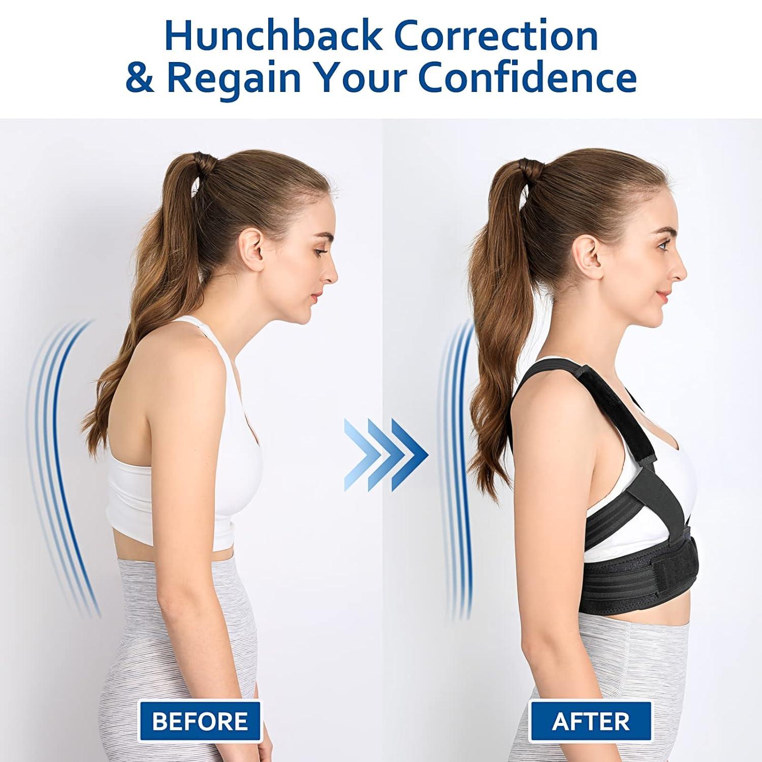 Mercase Posture Corrector for Women and Men - Adjustable Back Support ...