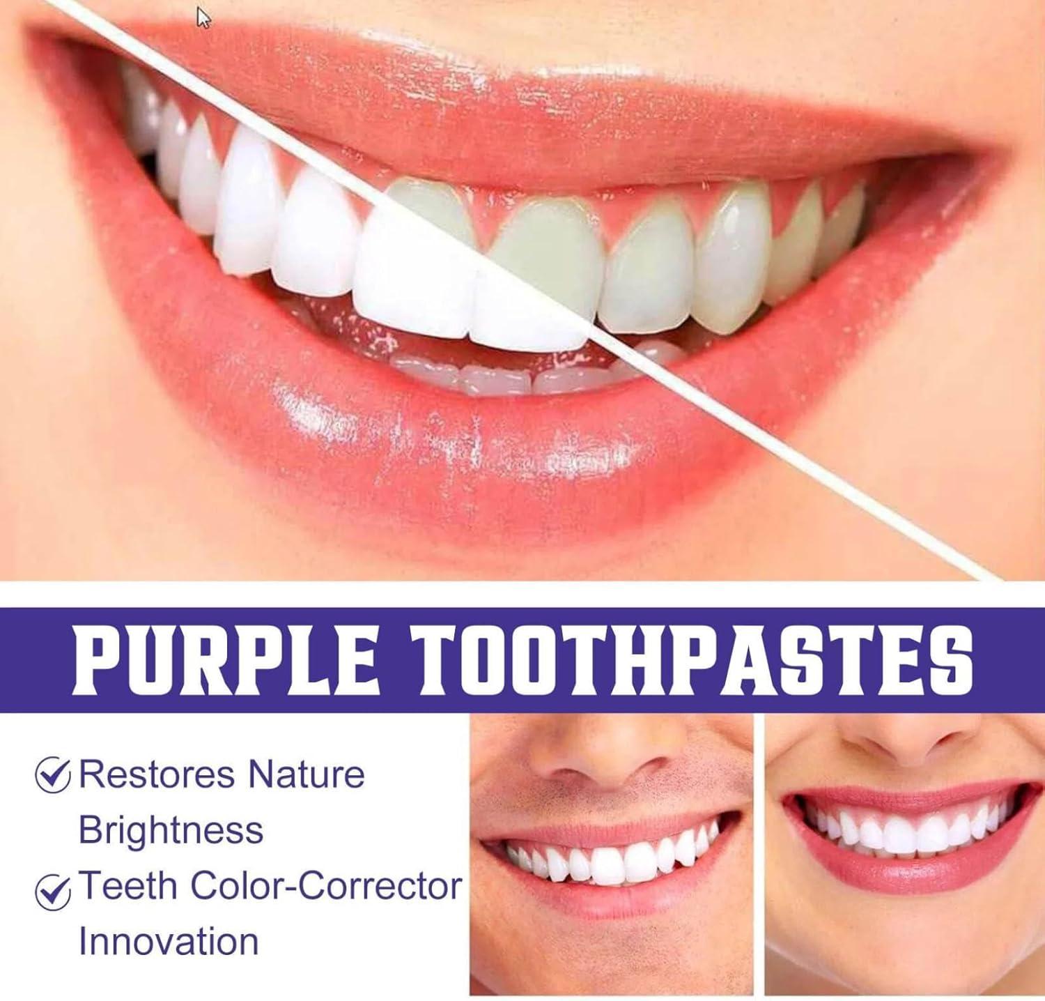 3 Pieces Purple Toothpaste for Whitening | Stain Removal & Brightening ...