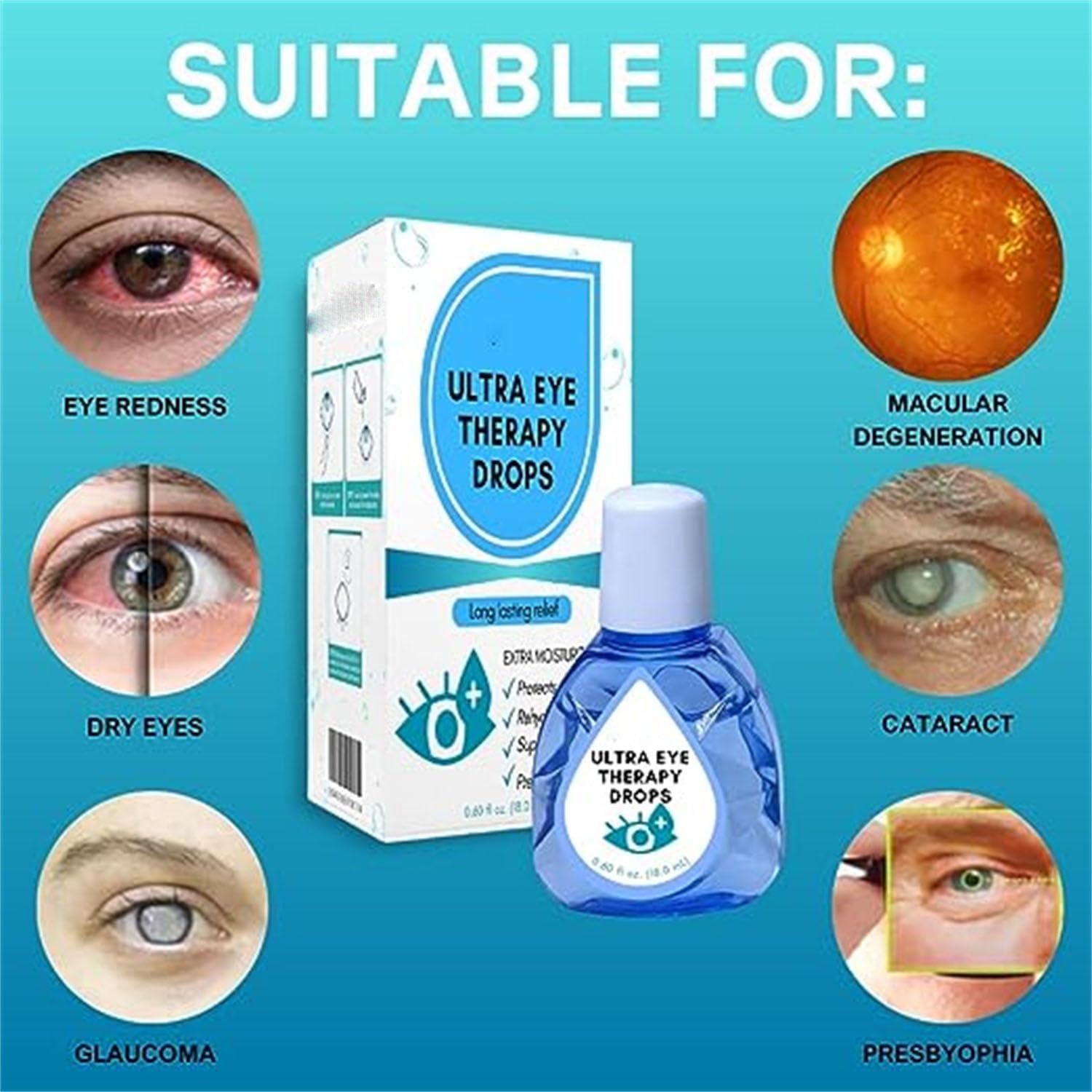 Hydravision Ultra Eye Therapy Drops | Red Eye Cure & Hydration | 3 PCs ...