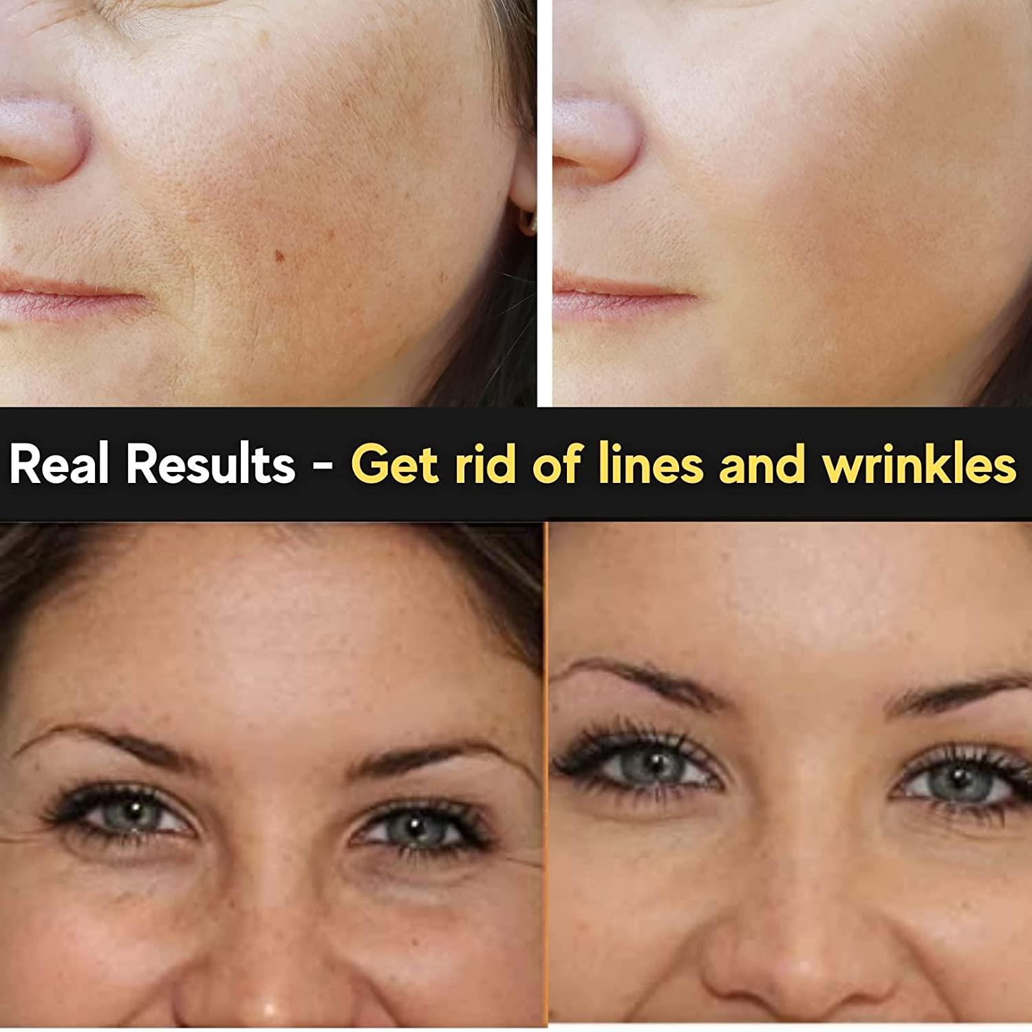 Facial Cupping Set for Glowing Skin & Anti-Wrinkle | Silicone Cups for ...