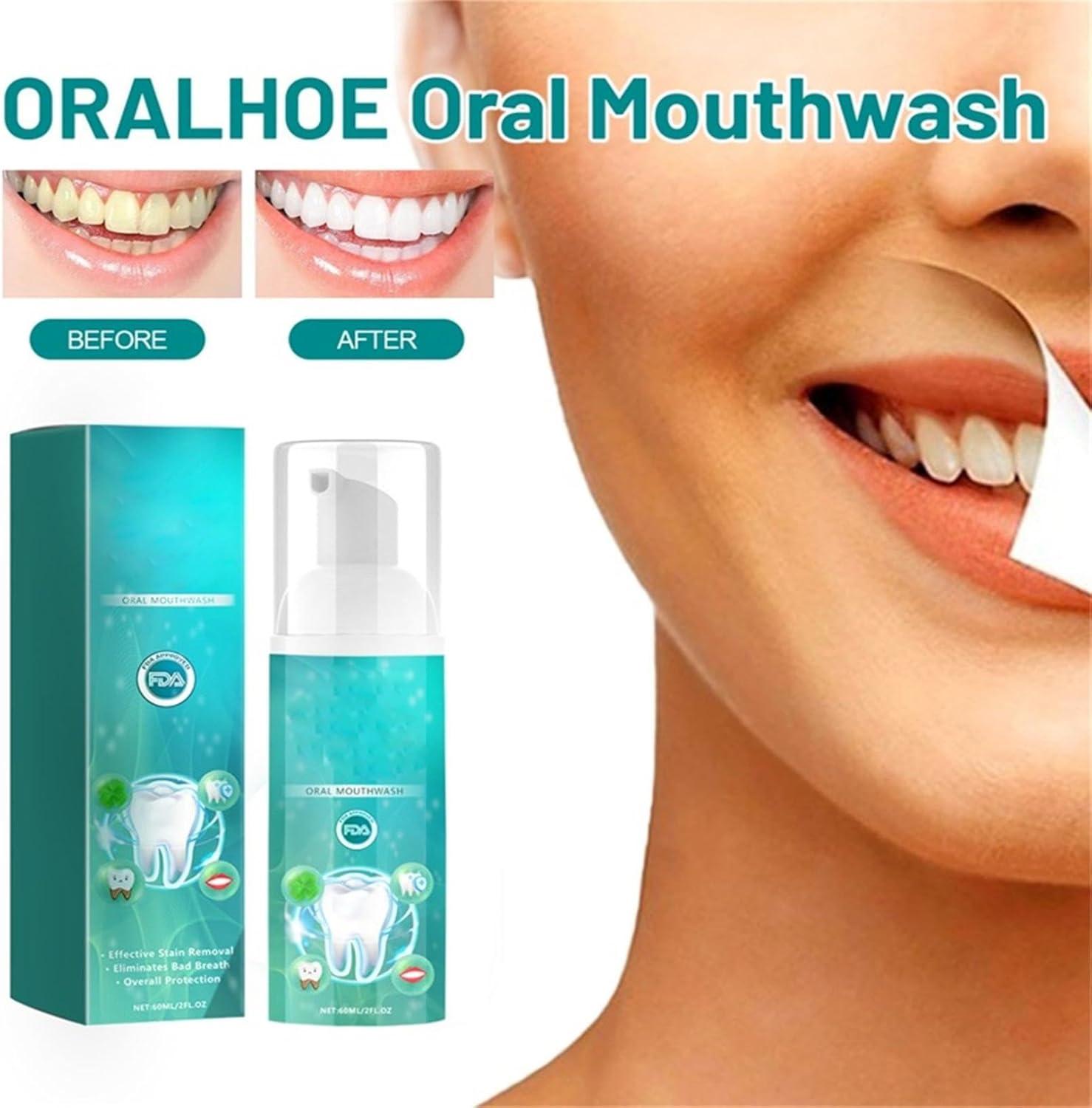 Furzero Smartsmile Mouthwash - 60ml Total Care Oral Rinse for Healthy ...