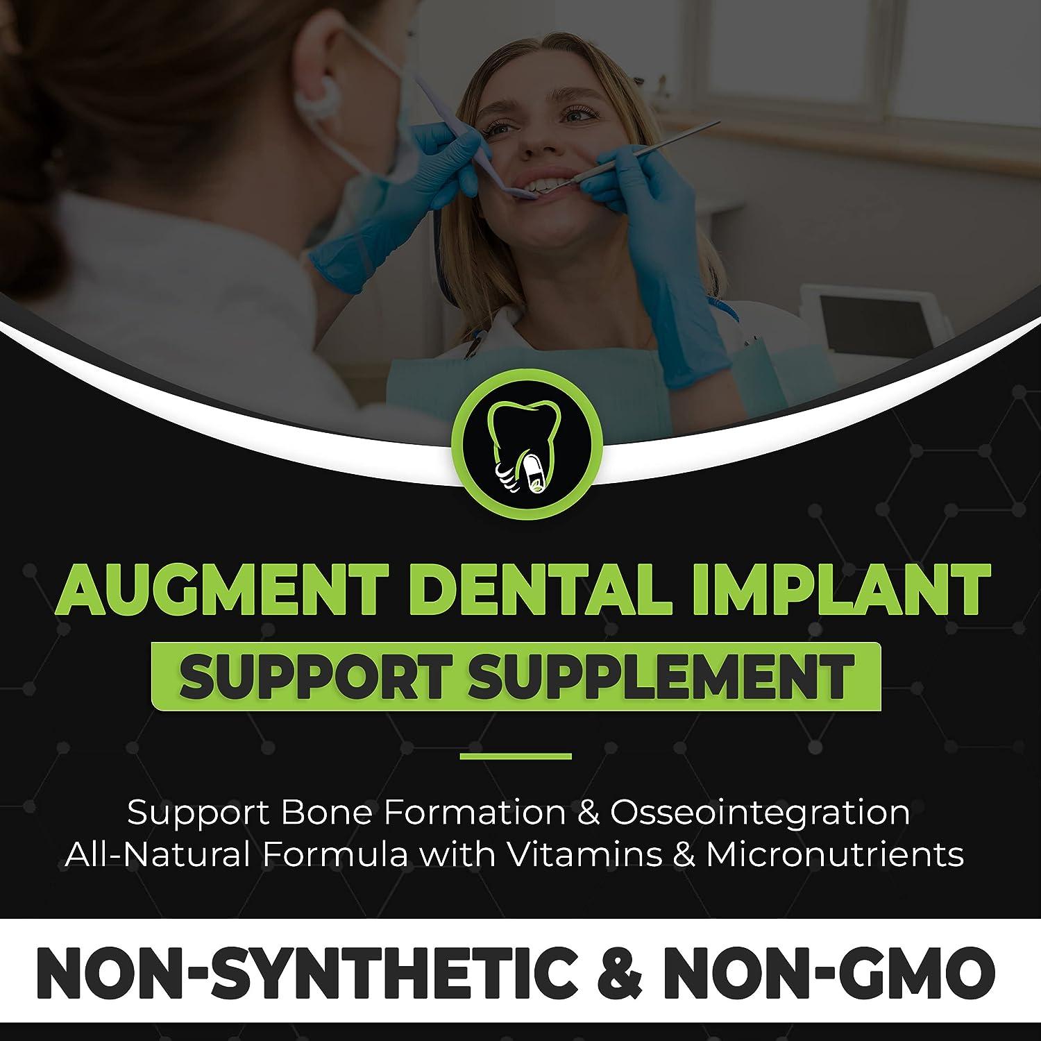Augment Nutrition Dental Implant Support Supplement - Natural Bone Formation & Osseointegration ...