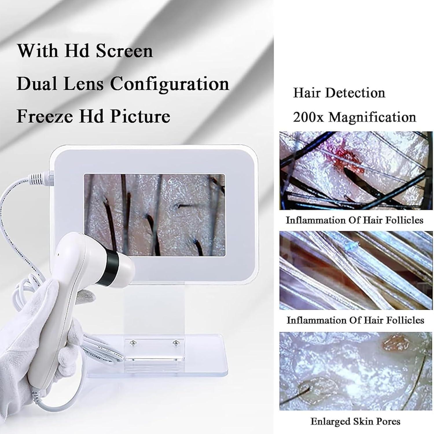 Skin Hair Analyzer Scalp Hair Detector with 2 Million Pixels HD LCD ...