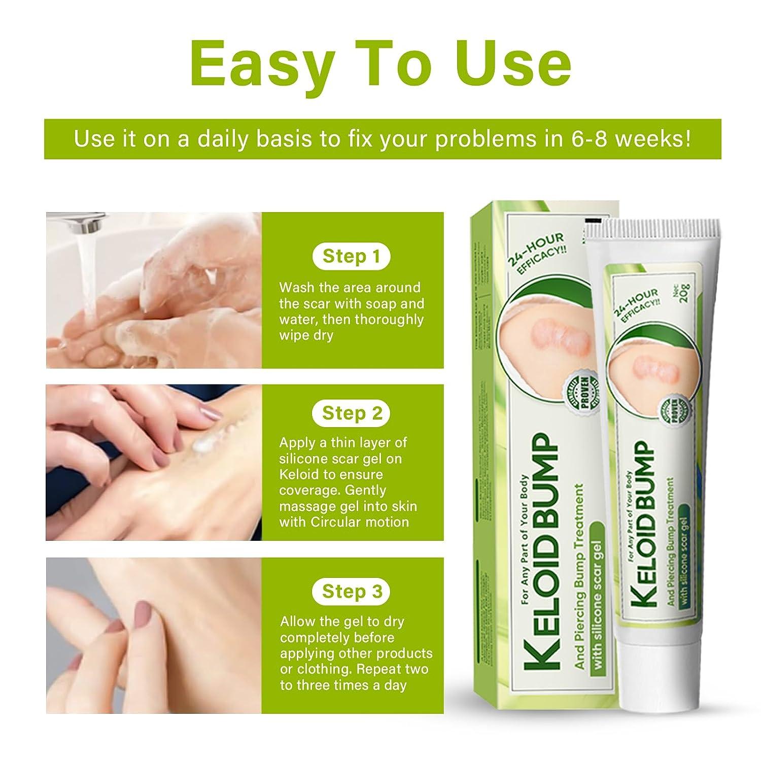 iTecFreely Keloid Scar Treatment for Nose & Belly Piercings - Silicone ...