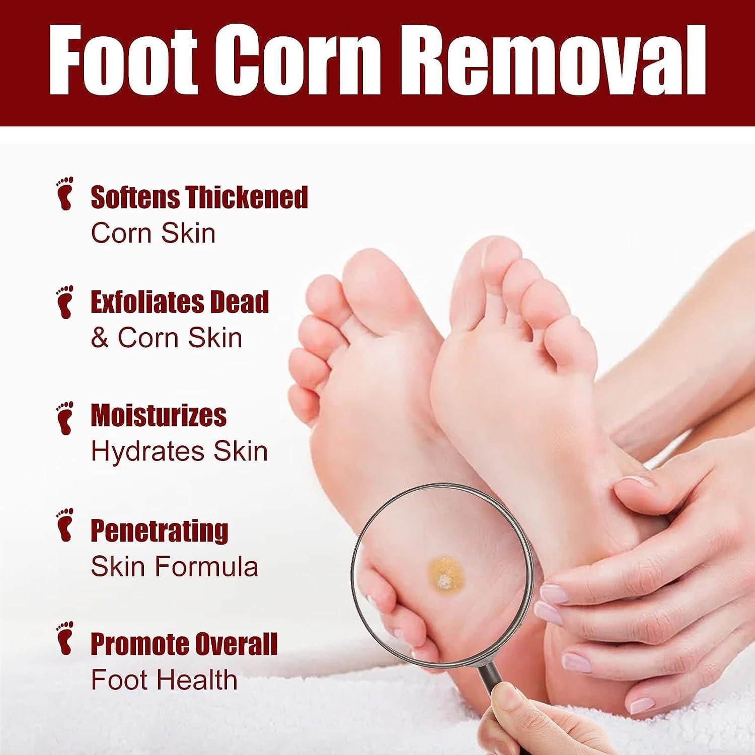 Extra Strength Foot Corn Removal Gel 10ml - Skin Smoothing & Repairing ...