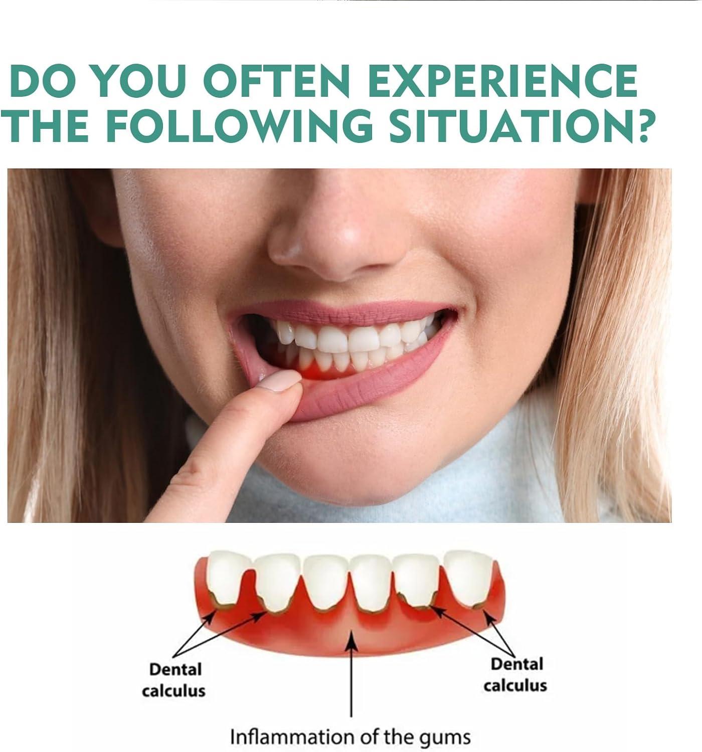 Ulcer Breath Sprays Oral Ulcer Sprays Mouth Ulcer Sprays Herbal Mouth ...