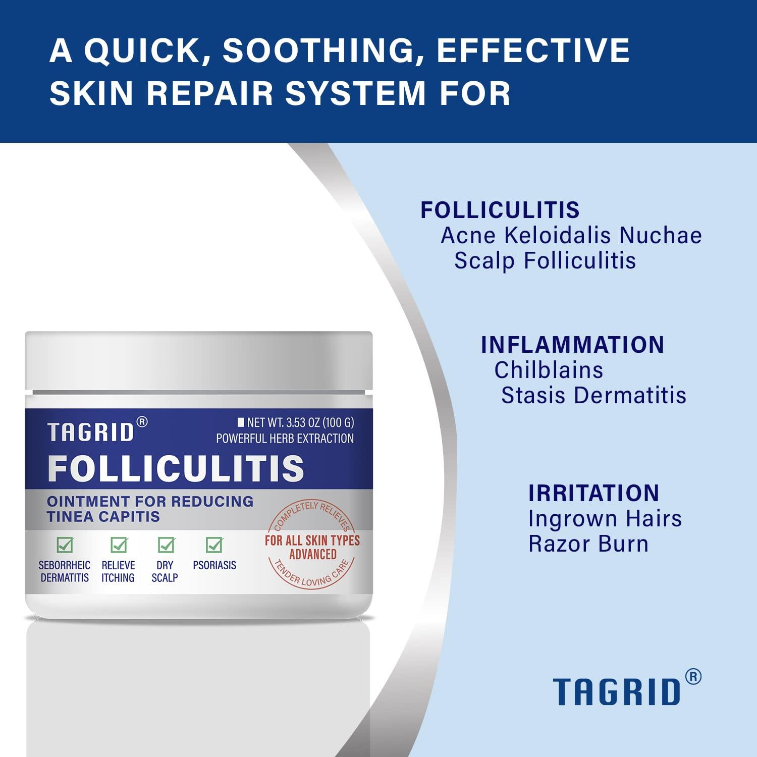 TAGRID Folliculitis Treatment Cream - Fast & Safe Relief for Severe ...