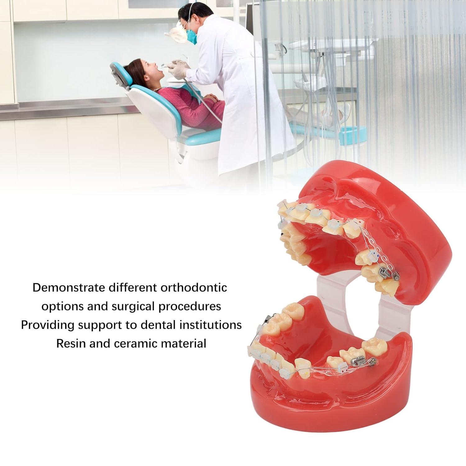 Orthodontic Bracket Model - 24 Teeth Dental Demonstration Model for ...