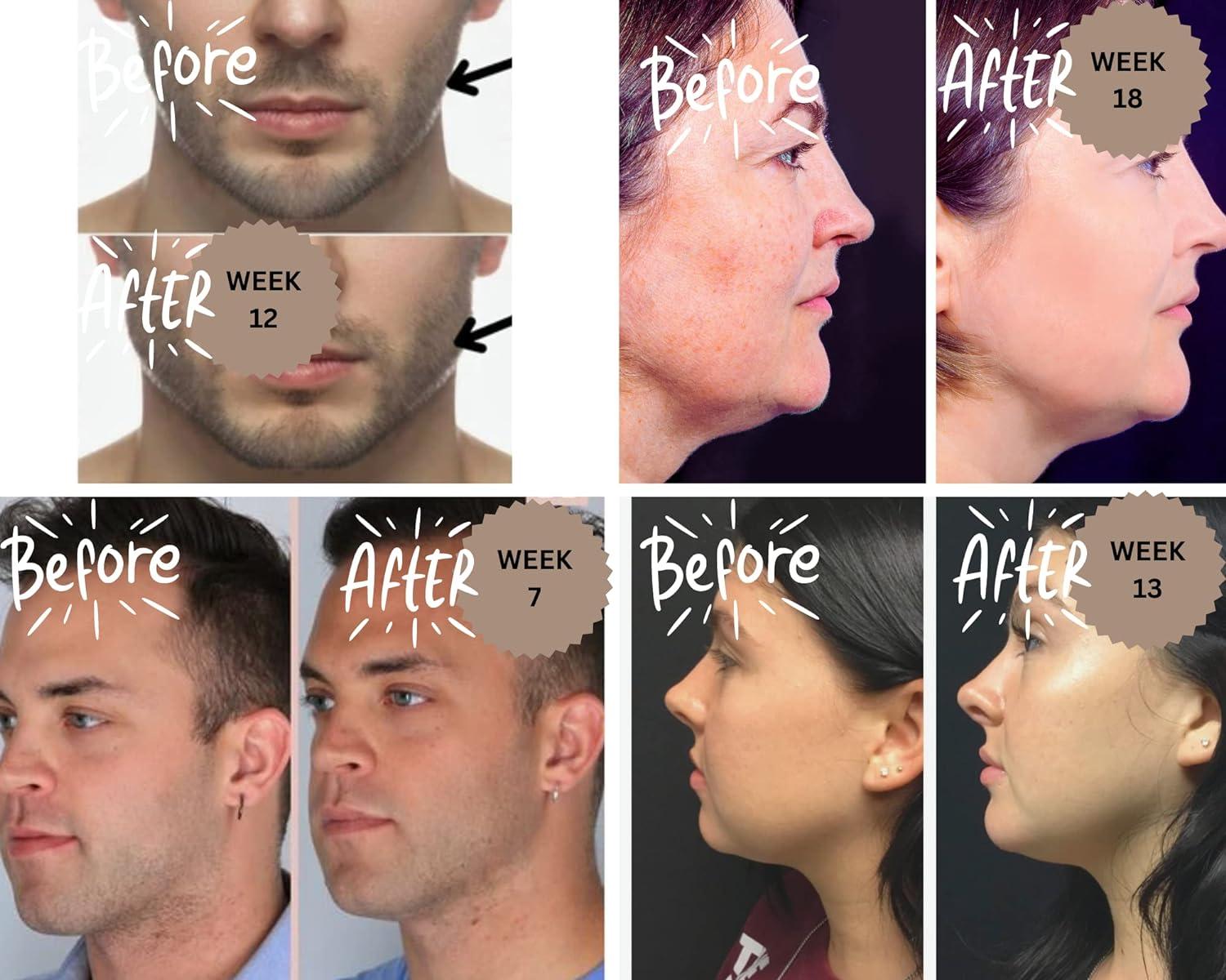 JawTone -Face & Jawline exercise HARD GUM mastic style hint of MINT ...