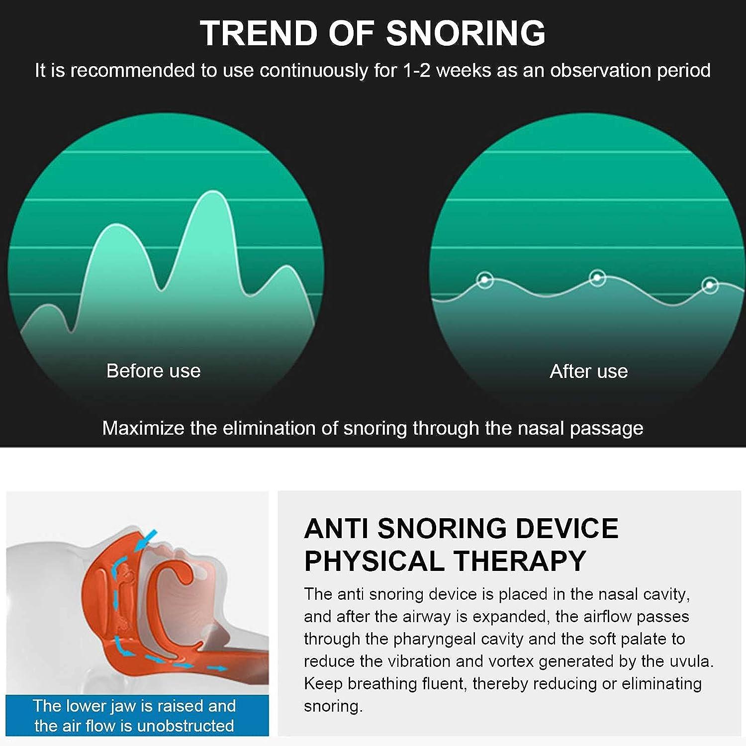 Anggrek Electric Nose Vents Plugs - Portable Silicone Air Purifier for ...