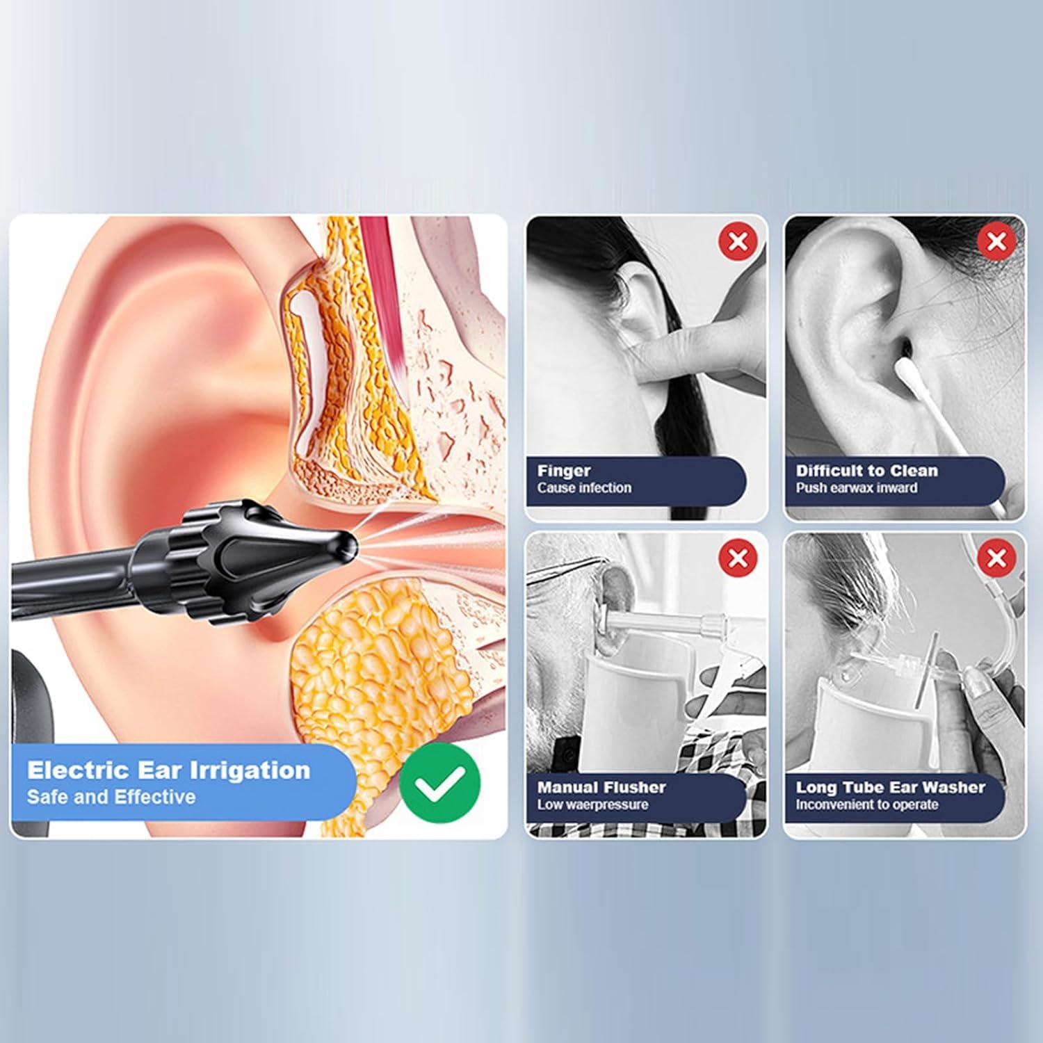 Best Ear Wax Removal Kit - Effective Ear Irrigation Flushing System ...