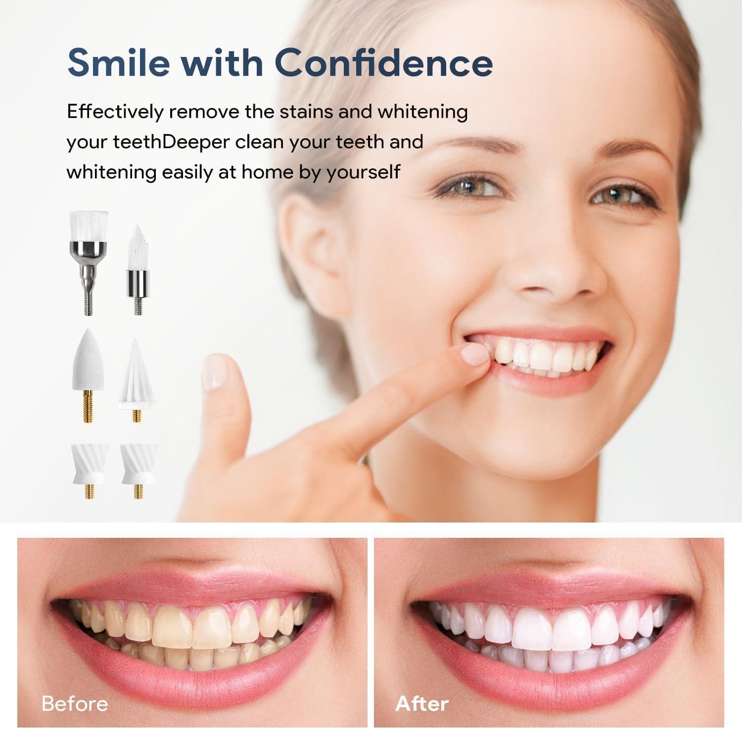 Electric Tooth Polisher Kit for Teeth Whitening & Stain Removal ...