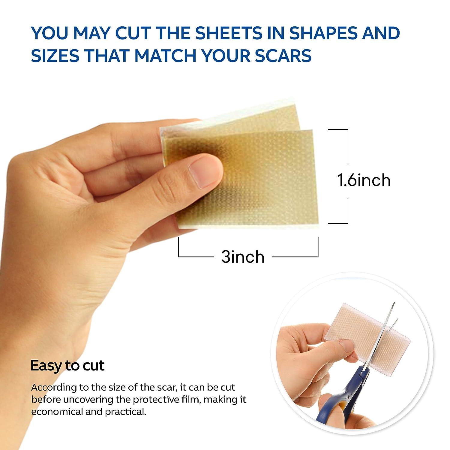 Puriderma Medical Silicone Scar Removal Sheets - Set of 5 | Fast ...