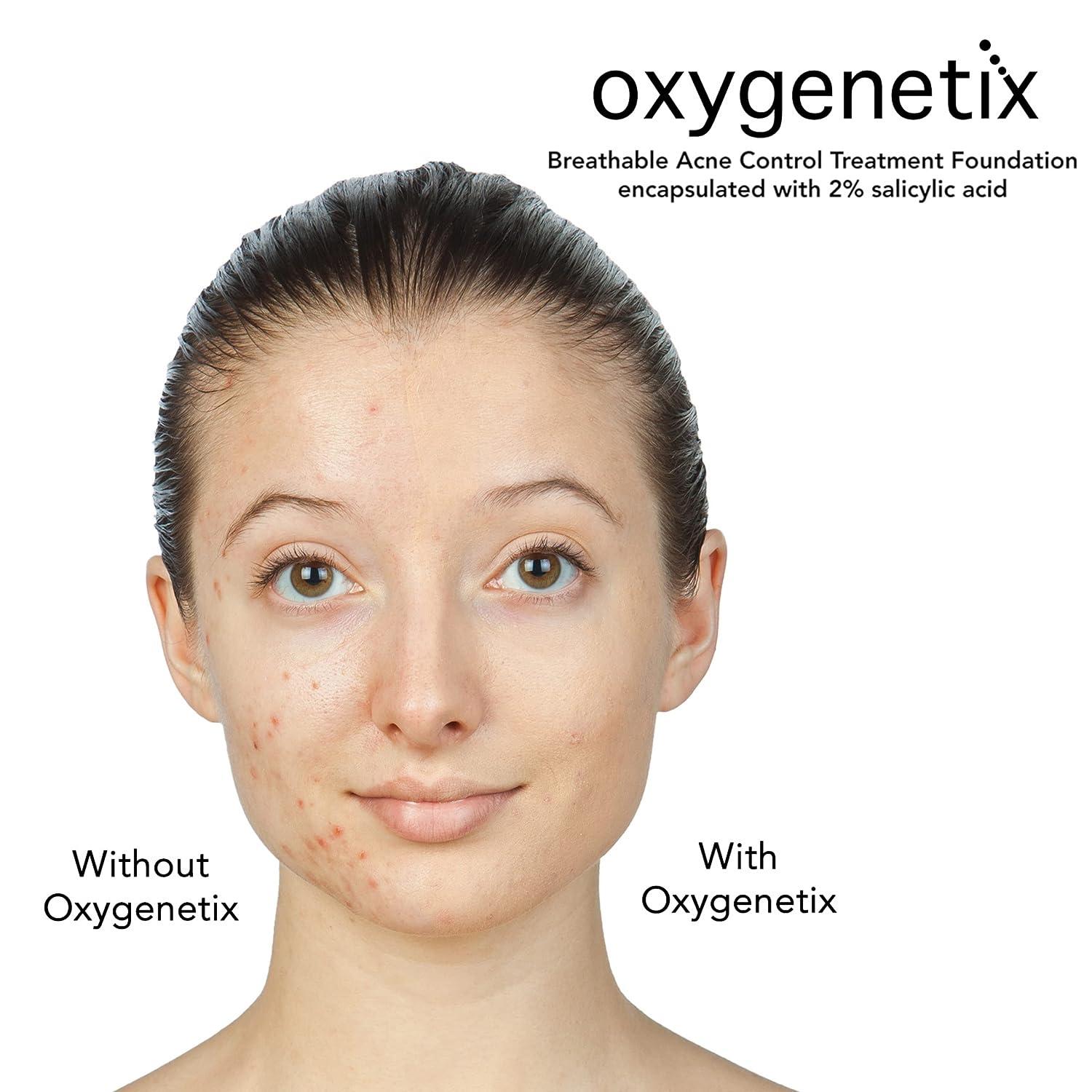 Oxygenetix Acne Control Foundation - 15ml - Pearl | Lightweight ...