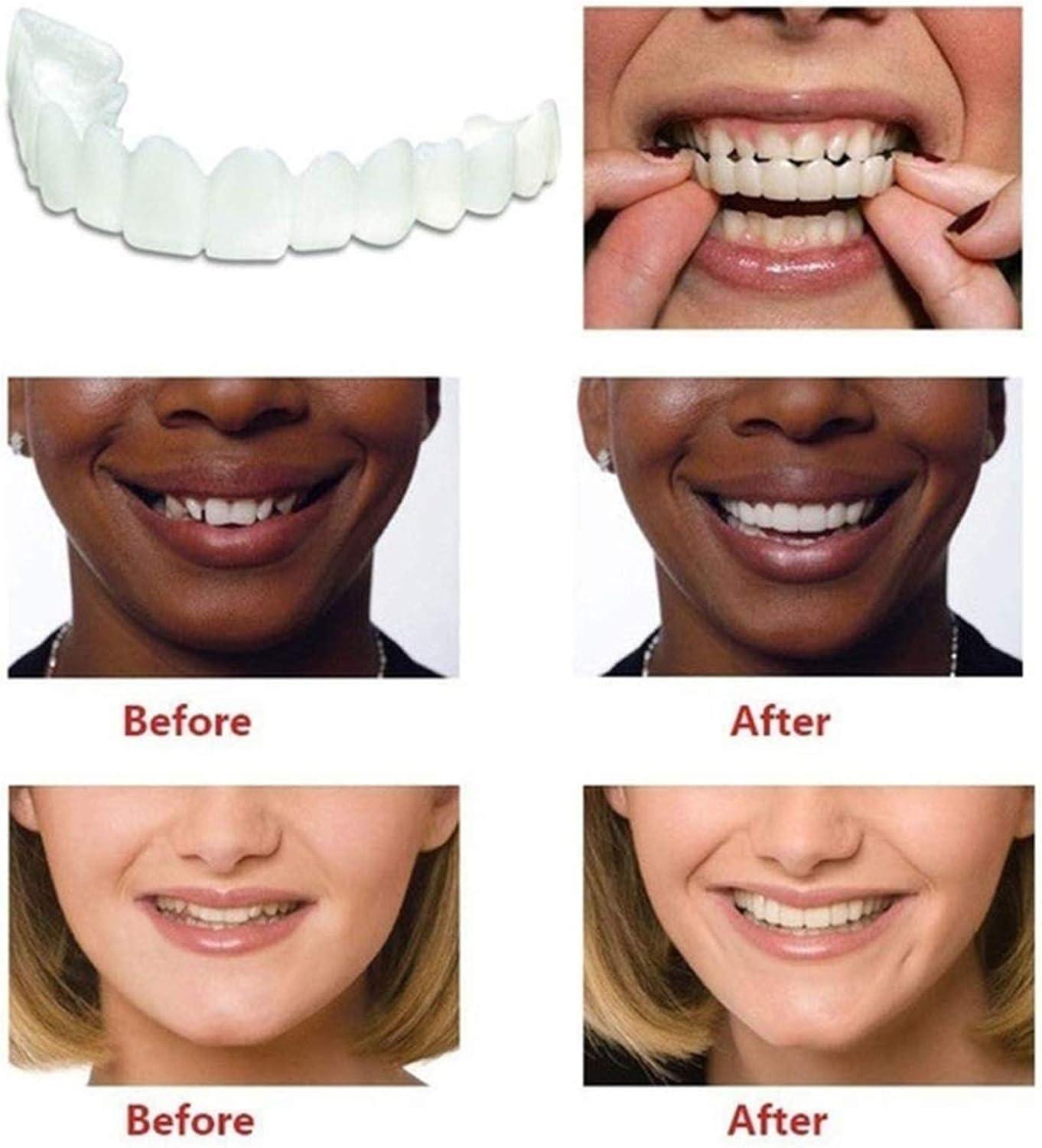 4 Pairs Cosmetic Teeth Veneers Teeth Temporary Dentures Upper and Lower ...
